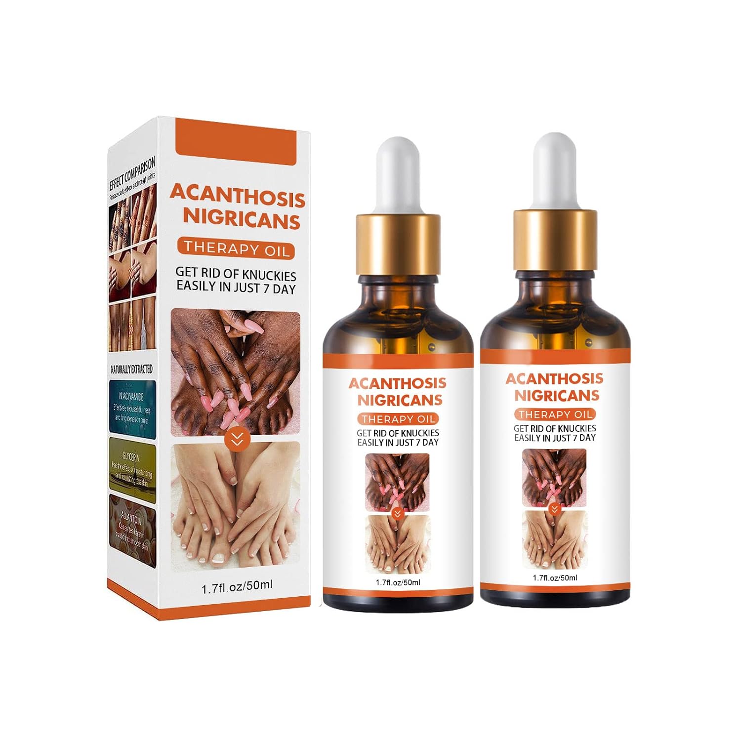 Amazon.com: Acanthosis Nigricans Therapy Oil, Dark Spot Corrector Oil ...