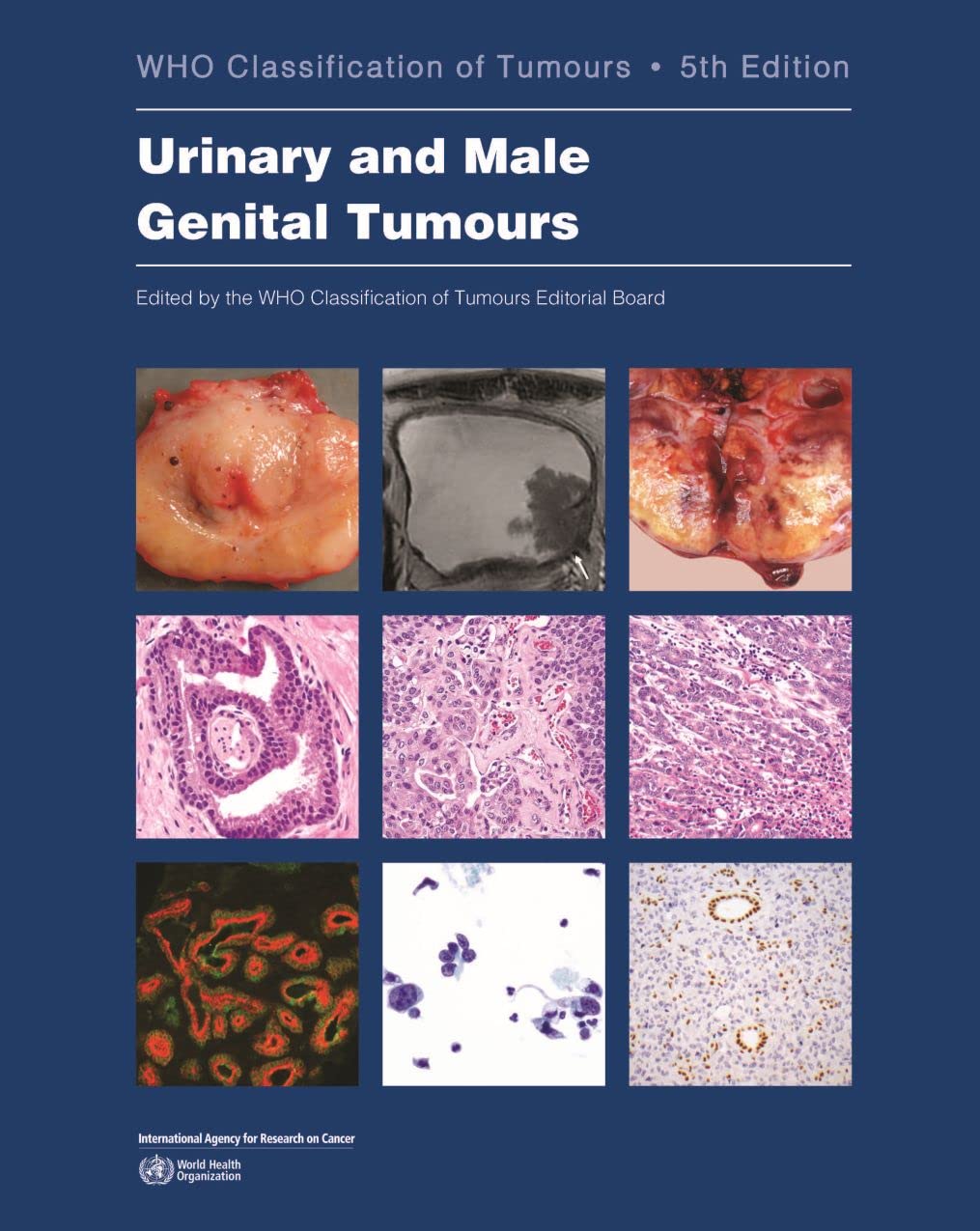 Buy WHO classification of tumours of the urinary system and male genital organs: 8 (World ...