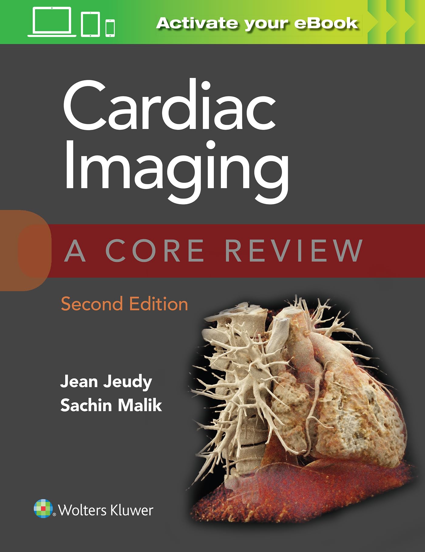 Cardiac Imaging: A Core Review: 9781975147990: Medicine & Health ...