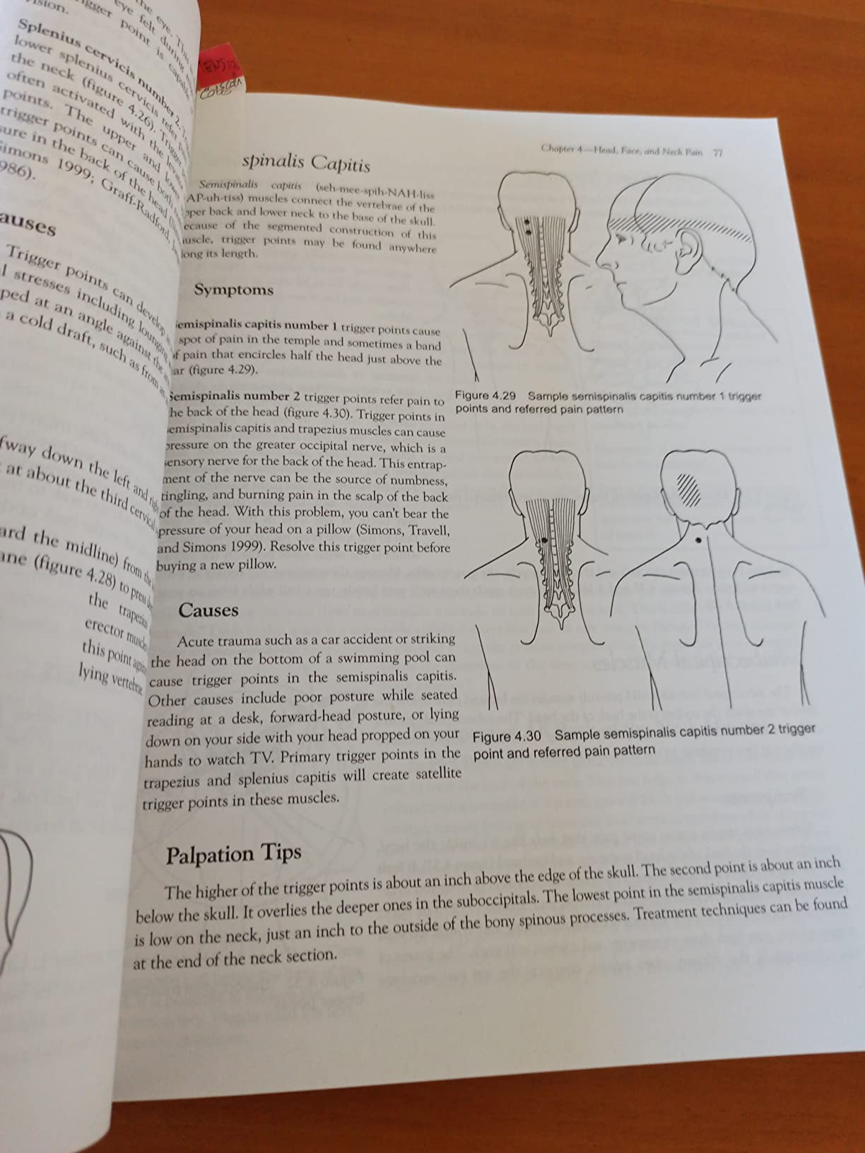 Trigger Point Therapy Workbook: Your Self-Treatment Guide for Pain ...