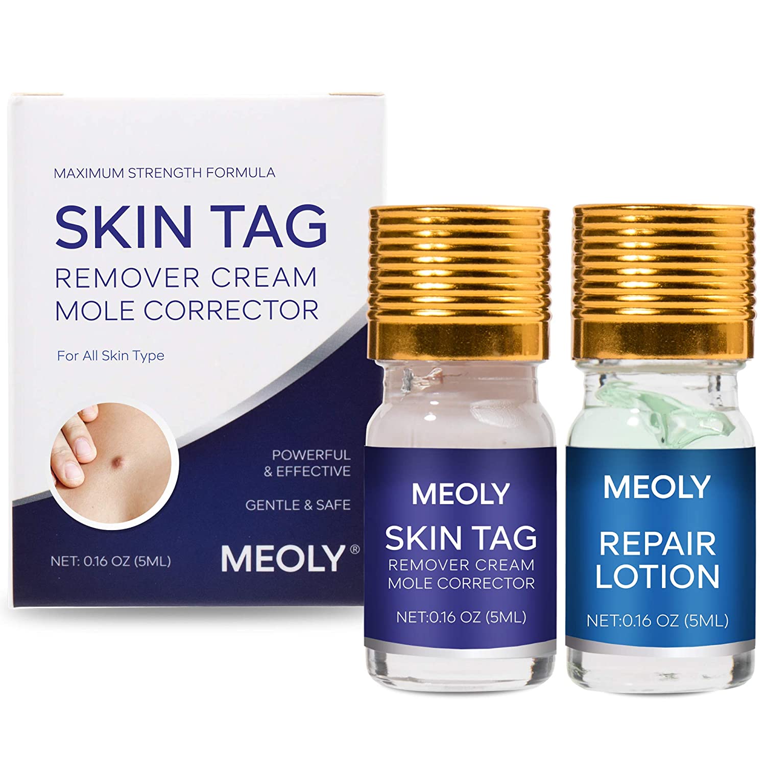 Watch MEOLY Mole Remover & Skin Tag Removal Repair Lotion Set on Amazon ...