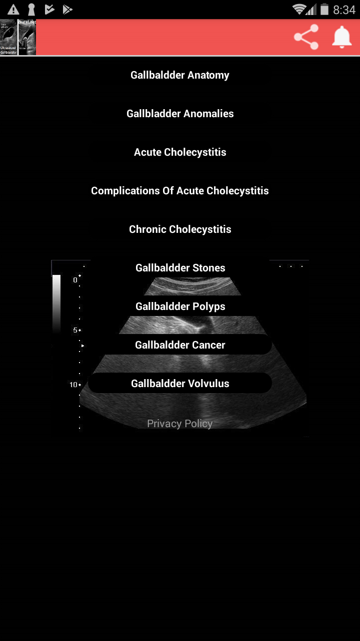 UltraSound Gallbladder - App on Amazon Appstore