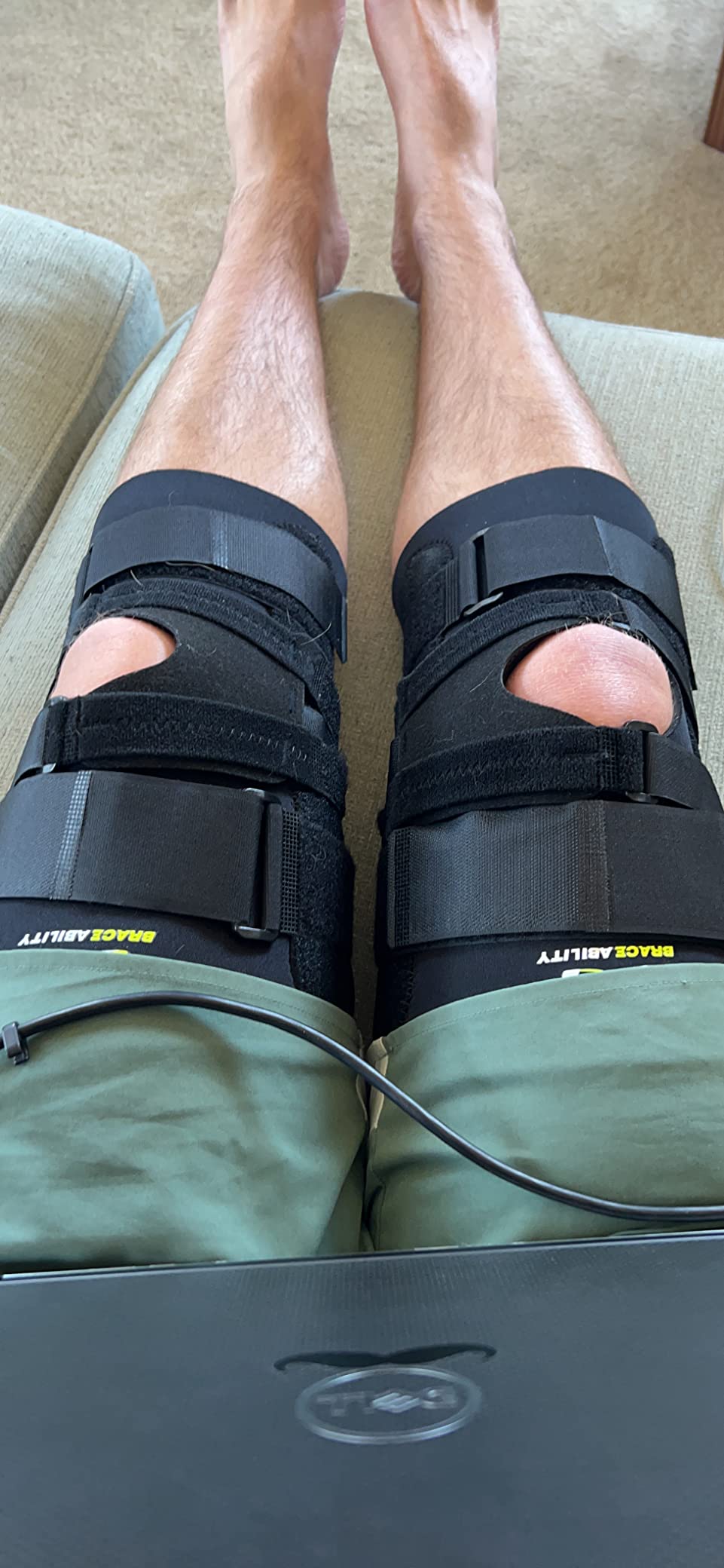 $11/mo - Finance BraceAbility J Patella Knee Brace - Lateral Patellar ...