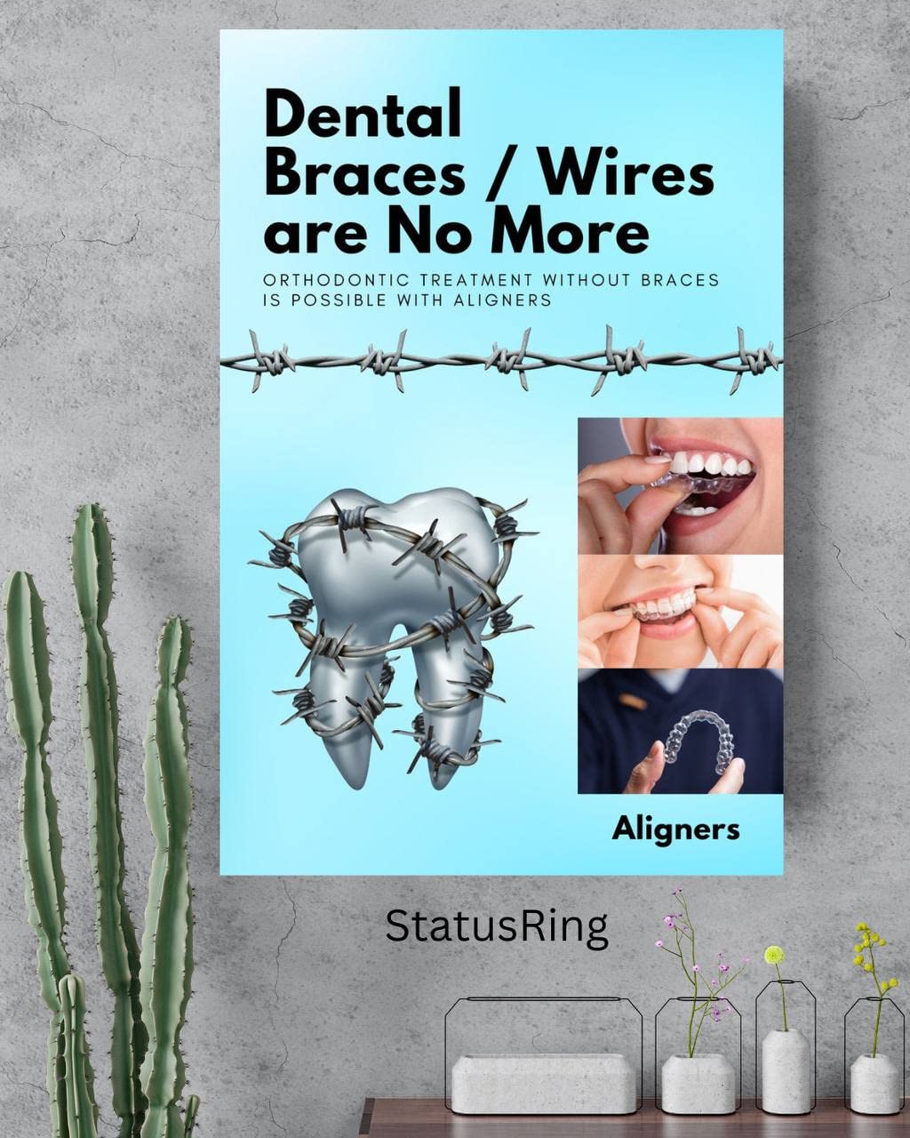 Orthodontics Braces Aligners Dental patient education poster : Amazon ...