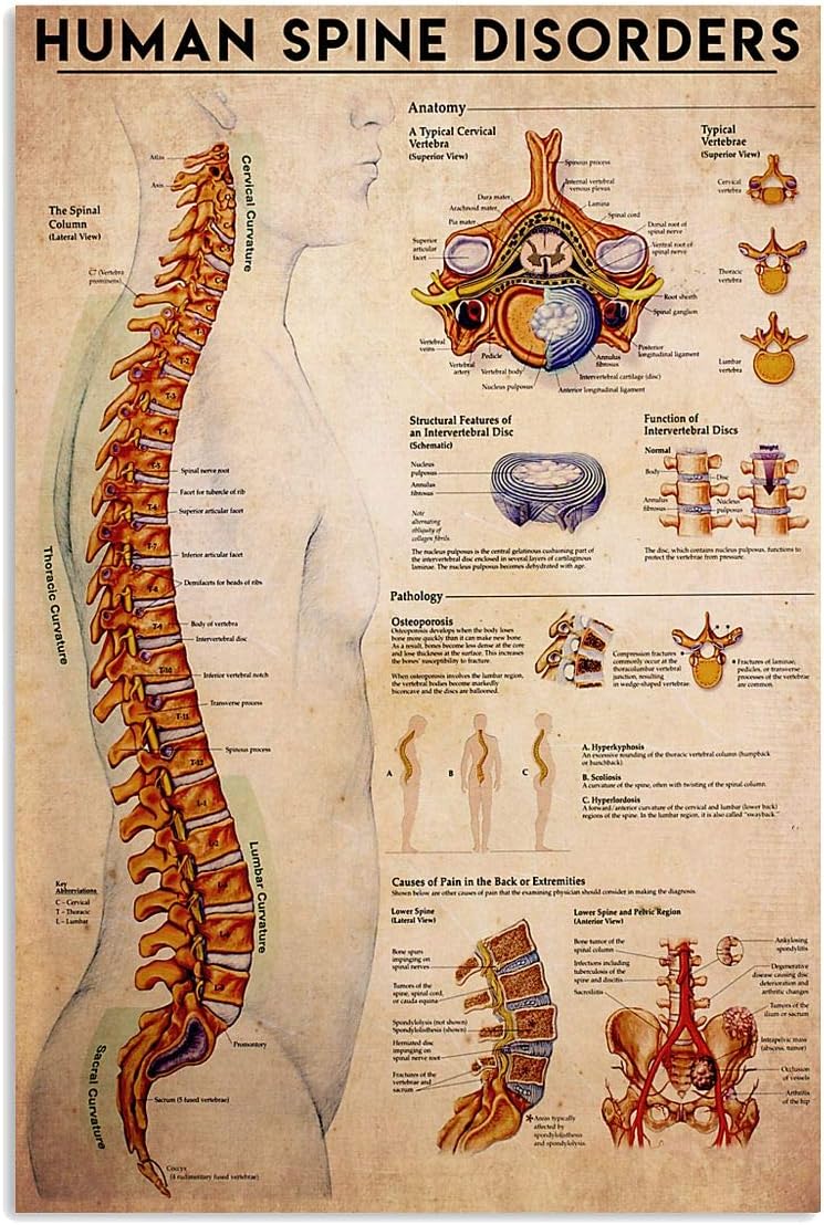 Amazon.com : Spine Knowledge Metal Tin Signs Human Spine Disorders ...