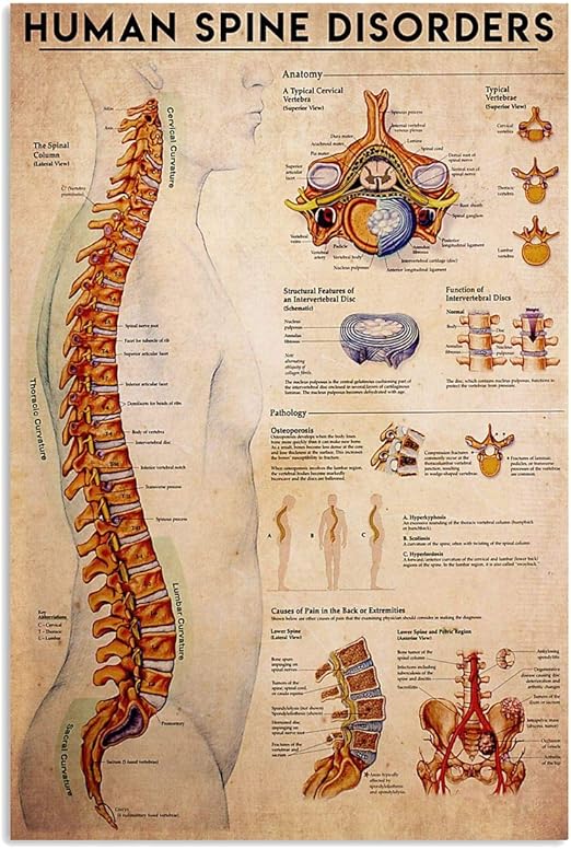 Amazon.com : Spine Knowledge Metal Tin Signs Human Spine Disorders ...