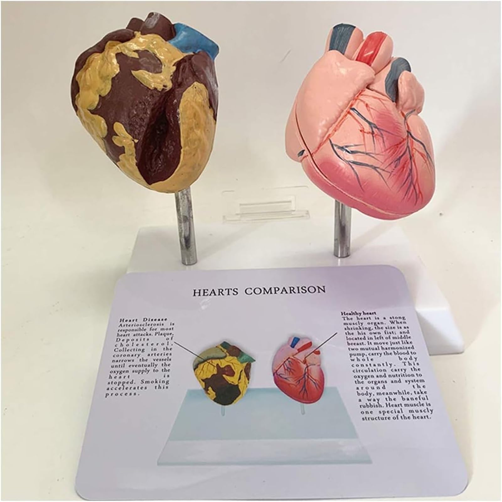 Echte Menselijke Hartanatomie De Menselijke Anatomie Van Het Hart