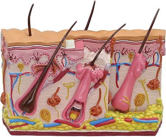 acne skin model Skin acne cross-section model Human Anatomy Models of ...