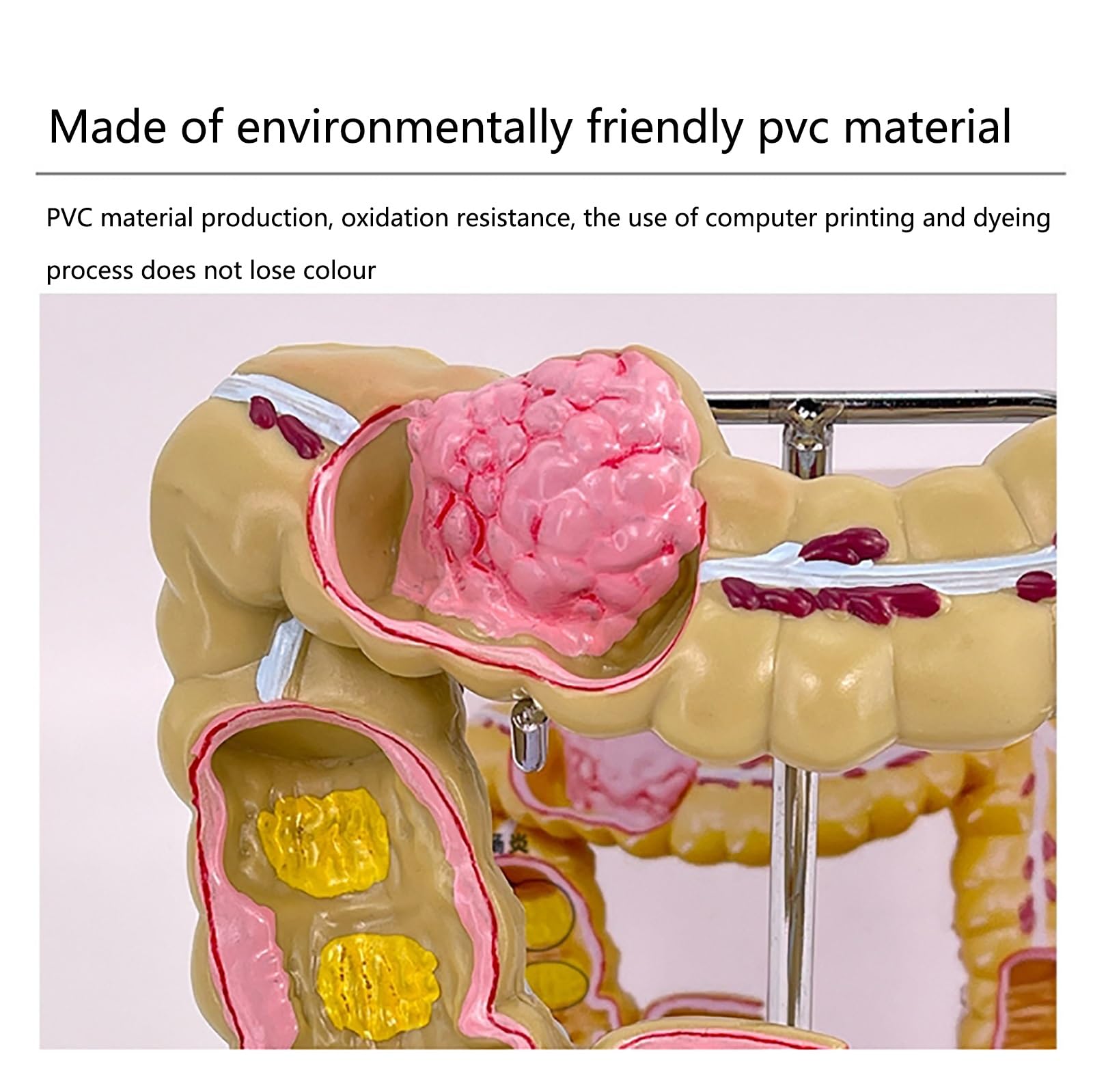 Real Human Large Intestine Human Large Intestine #2 By Science Photo