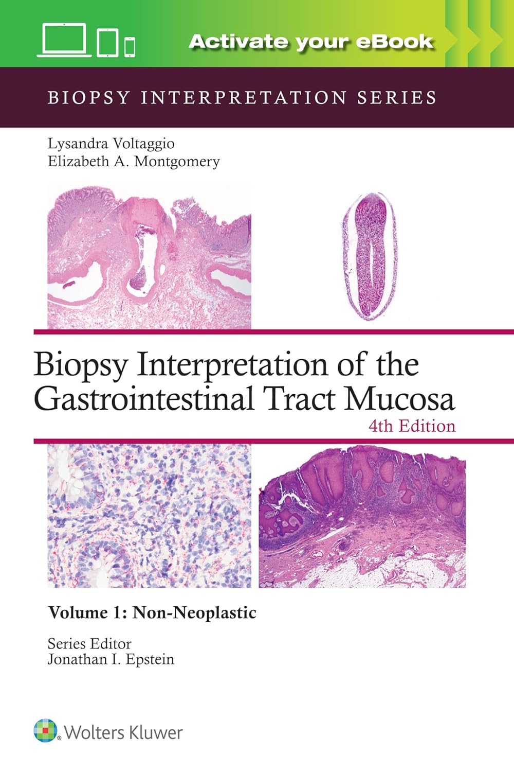 Biopsy Interpretation of the Gastrointestinal Tract Mucosa Volume 1 ...