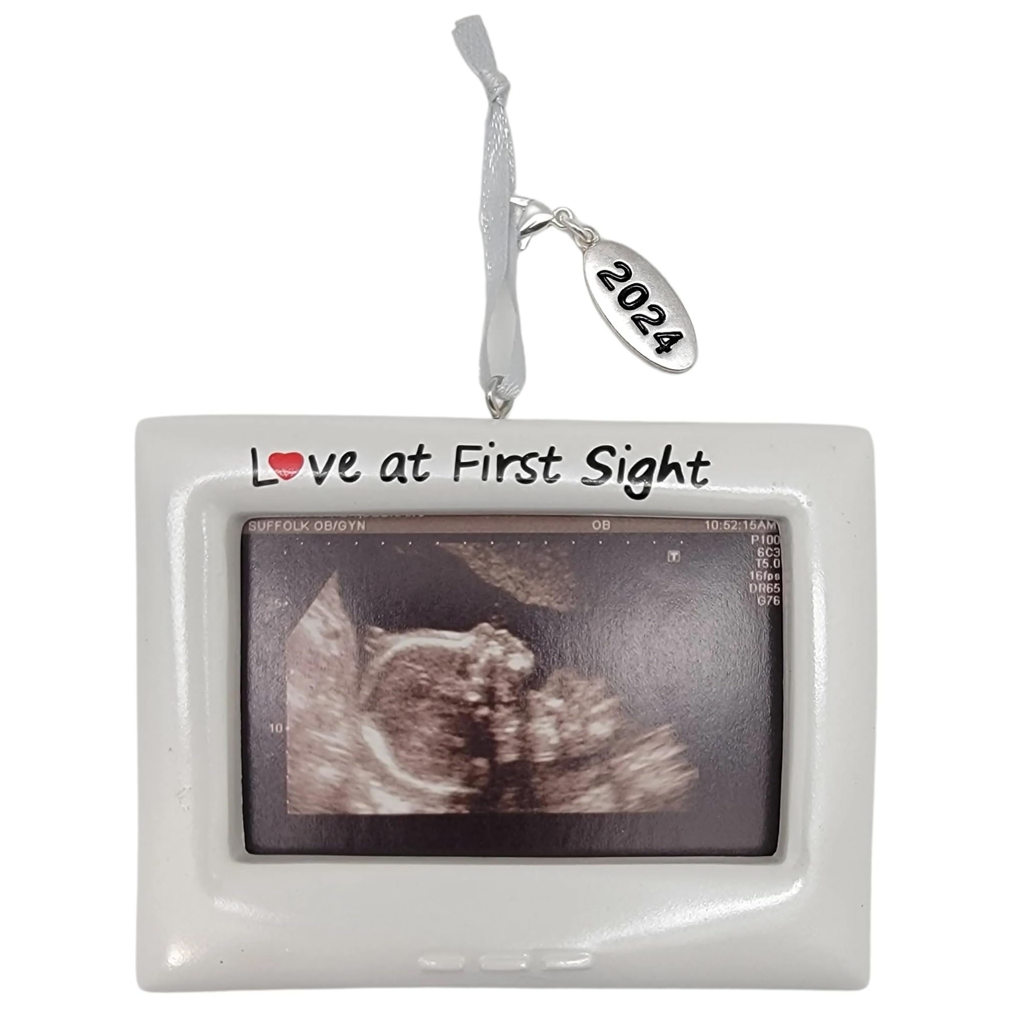 Amazon.com: Sonogram Photo Frame Ornament Ultrasound Baby's First Photo ...