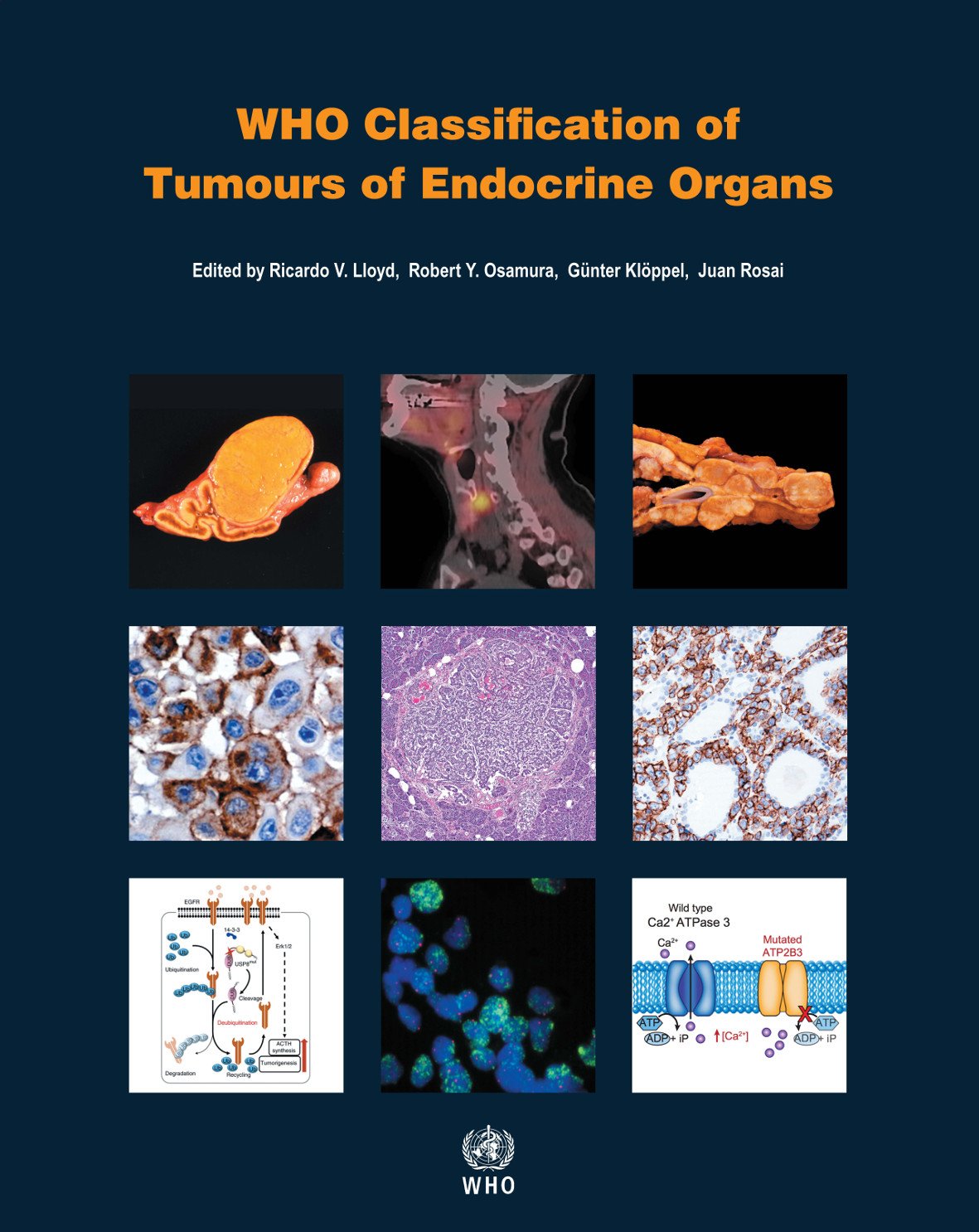Buy WHO classification of tumours of endocrine organs Online at ...