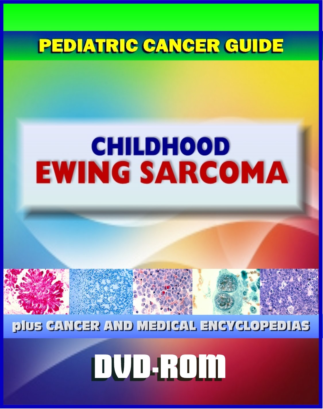Childhood Ewing Sarcoma Family of Tumors (Bone, PNET, Extraosseous ...