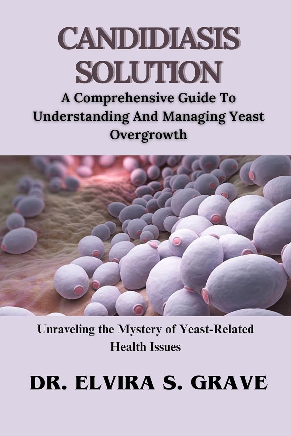 CANDIDIASIS SOLUTION: A Comprehensive Guide To Understanding And ...