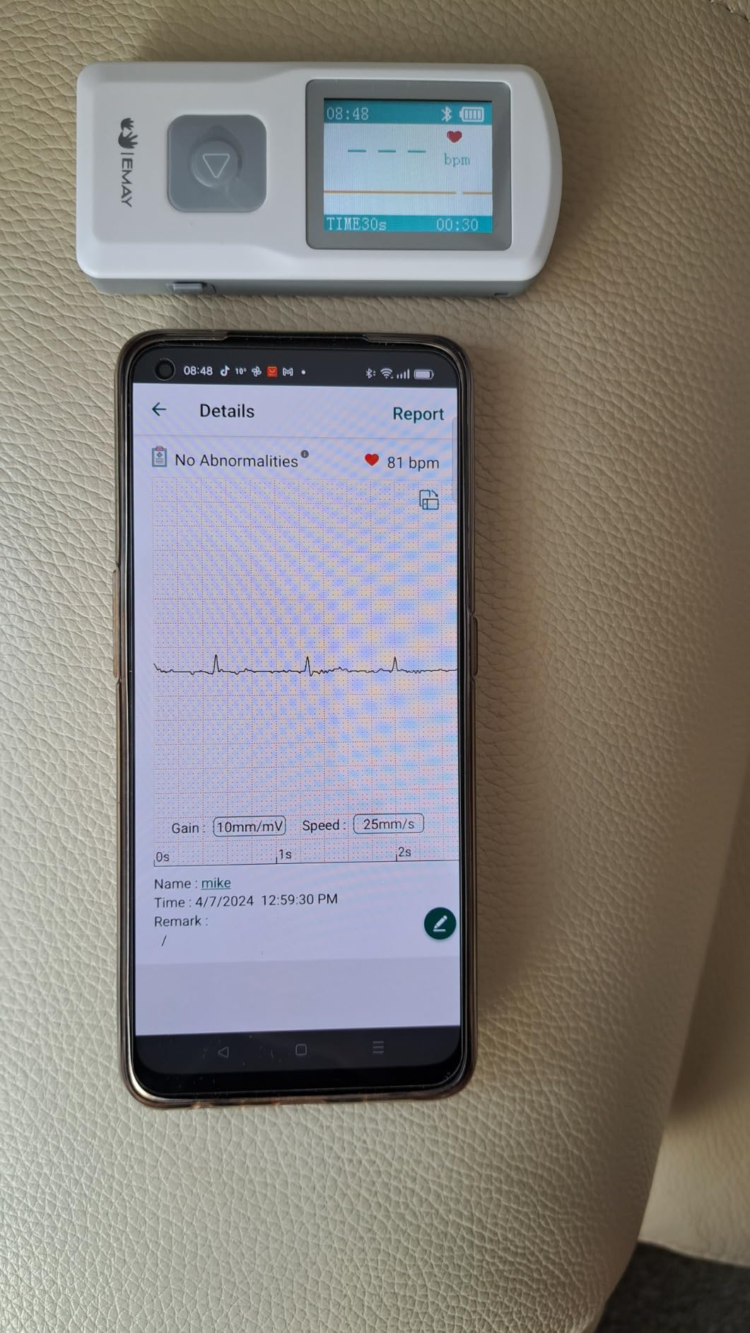 EMAY Bluetooth Portable ECG/EKG Monitor (for iPhone & Android, Mac ...