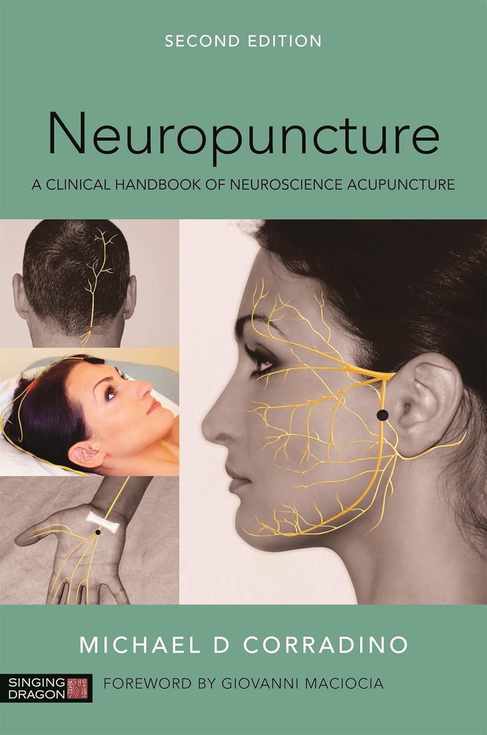Neuropuncture: A Clinical Handbook of Neuroscience Acupuncture, Second ...