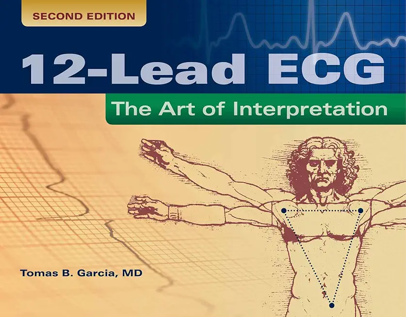 Assessing Stroke Patients: Why 12-Lead Ecg Is Essential | MedShun
