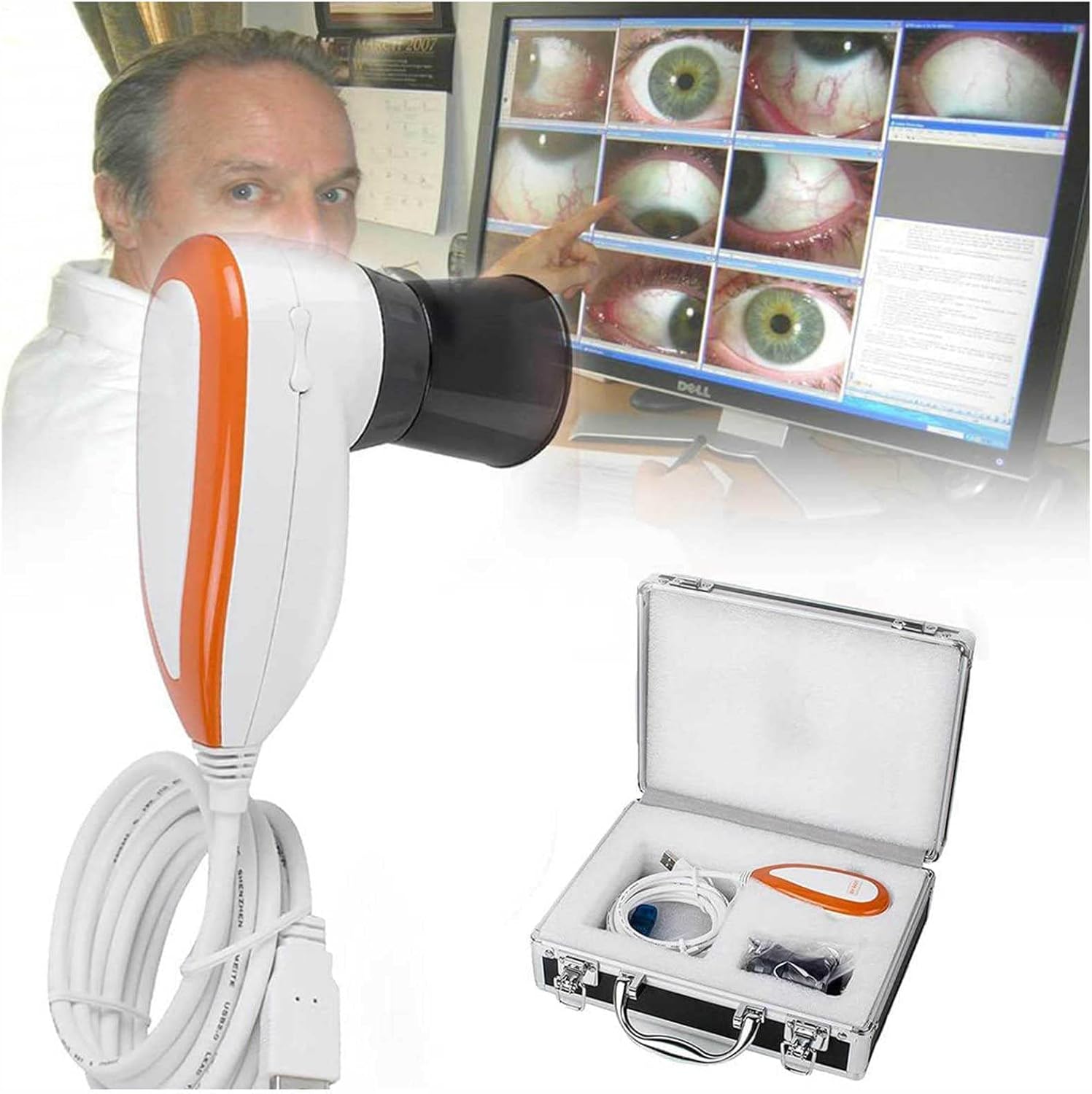Iris Analysis Camera,Iris Magnifier Eye Iris Camera,5 Million Pixel ...
