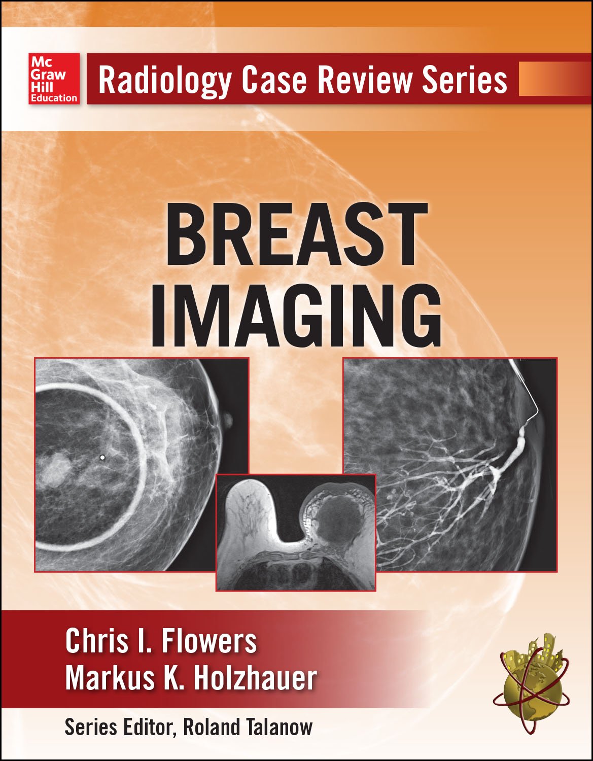 Amazon.com: Radiology Case Review Series: Breast Imaging eBook ...