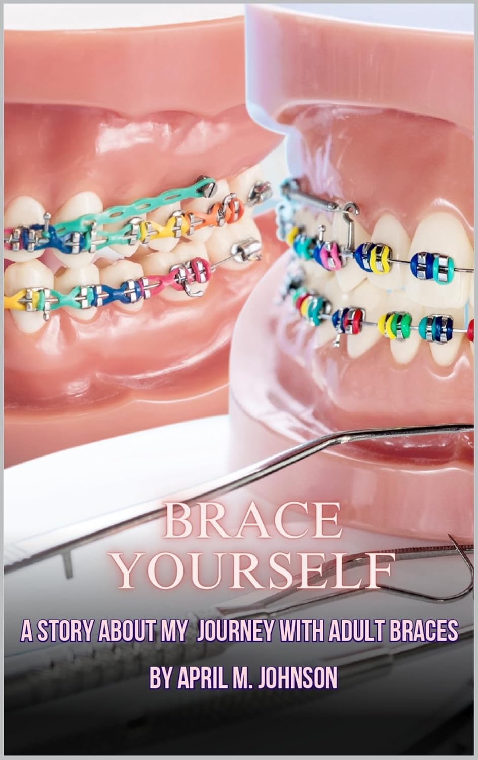 Brace Yourself: A Story About My Journey With Adult Braces eBook ...