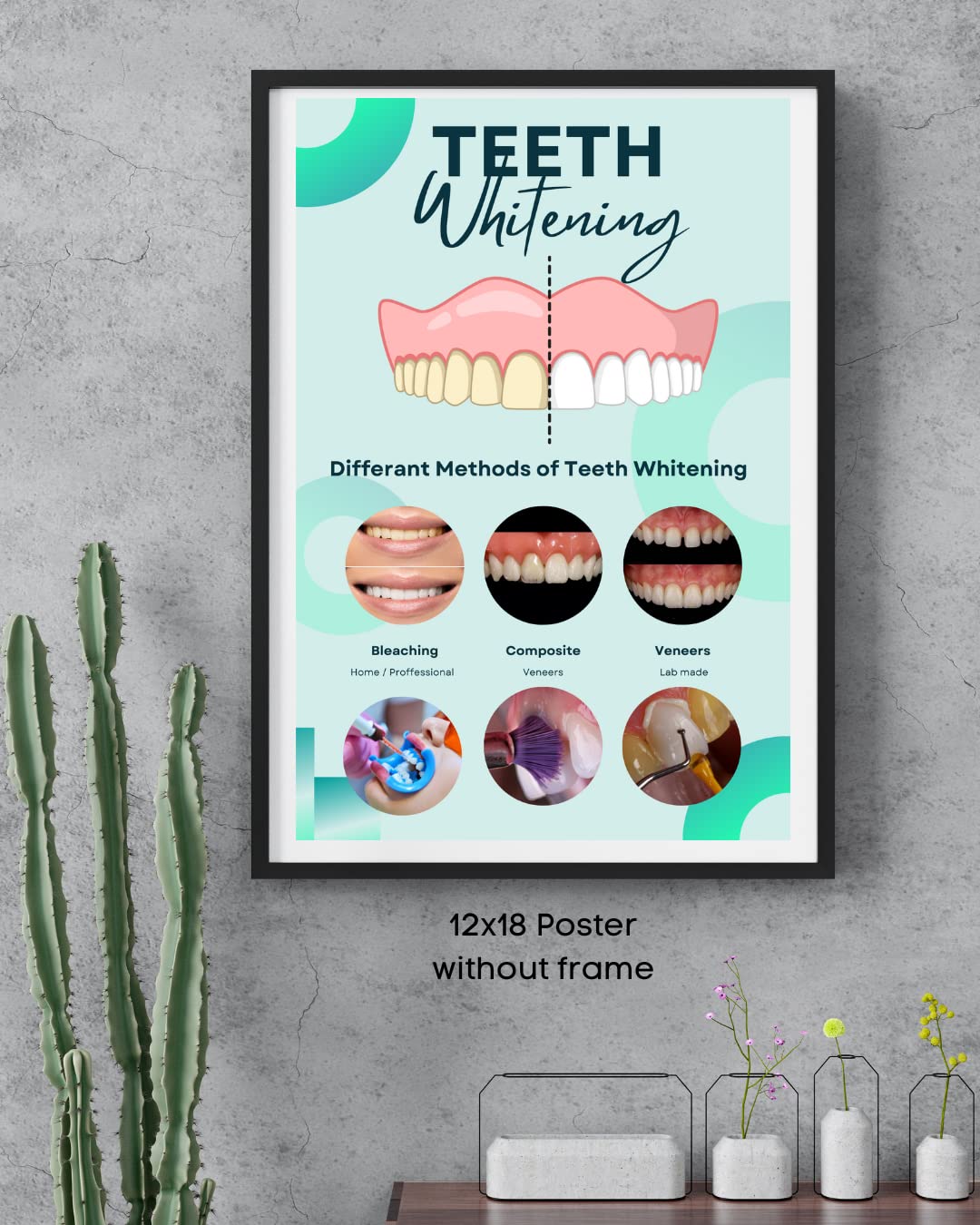Teeth whitening Dental patient education poster without frame : Amazon ...
