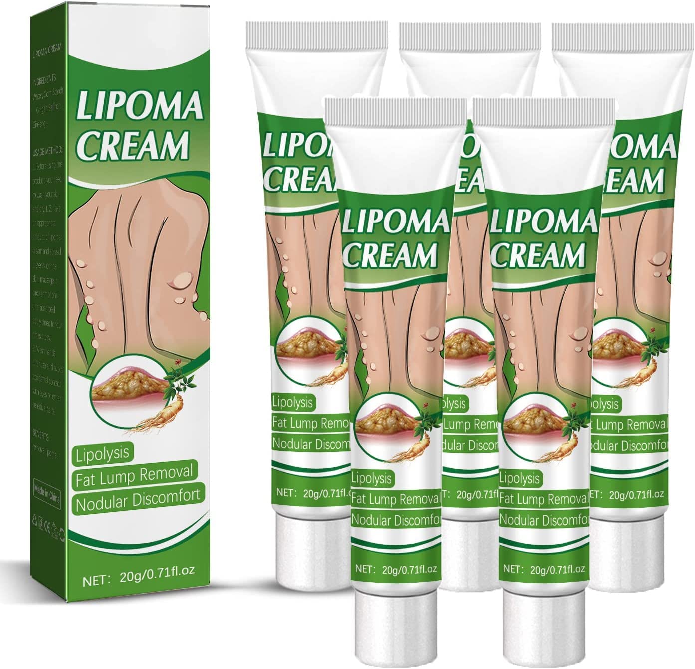 Lipomacure Soothing Ointment Lumpfree Lipoma Removal Cream Herbal ...