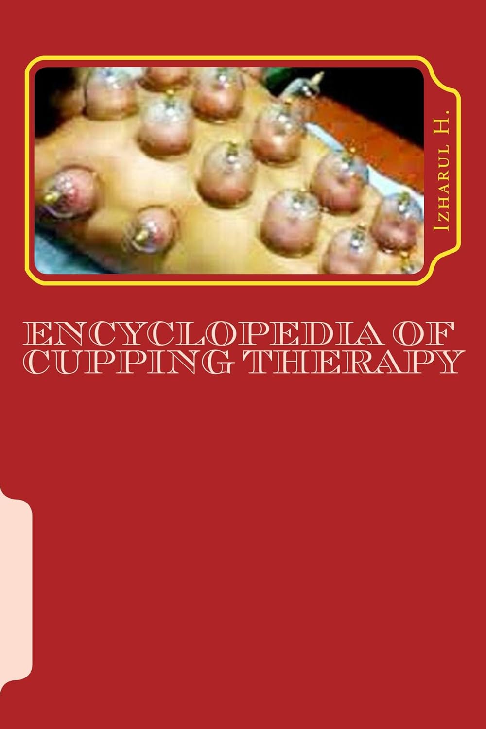 Amazon.com: Encyclopedia of Cupping Therapy eBook : H., Izharul: Kindle ...