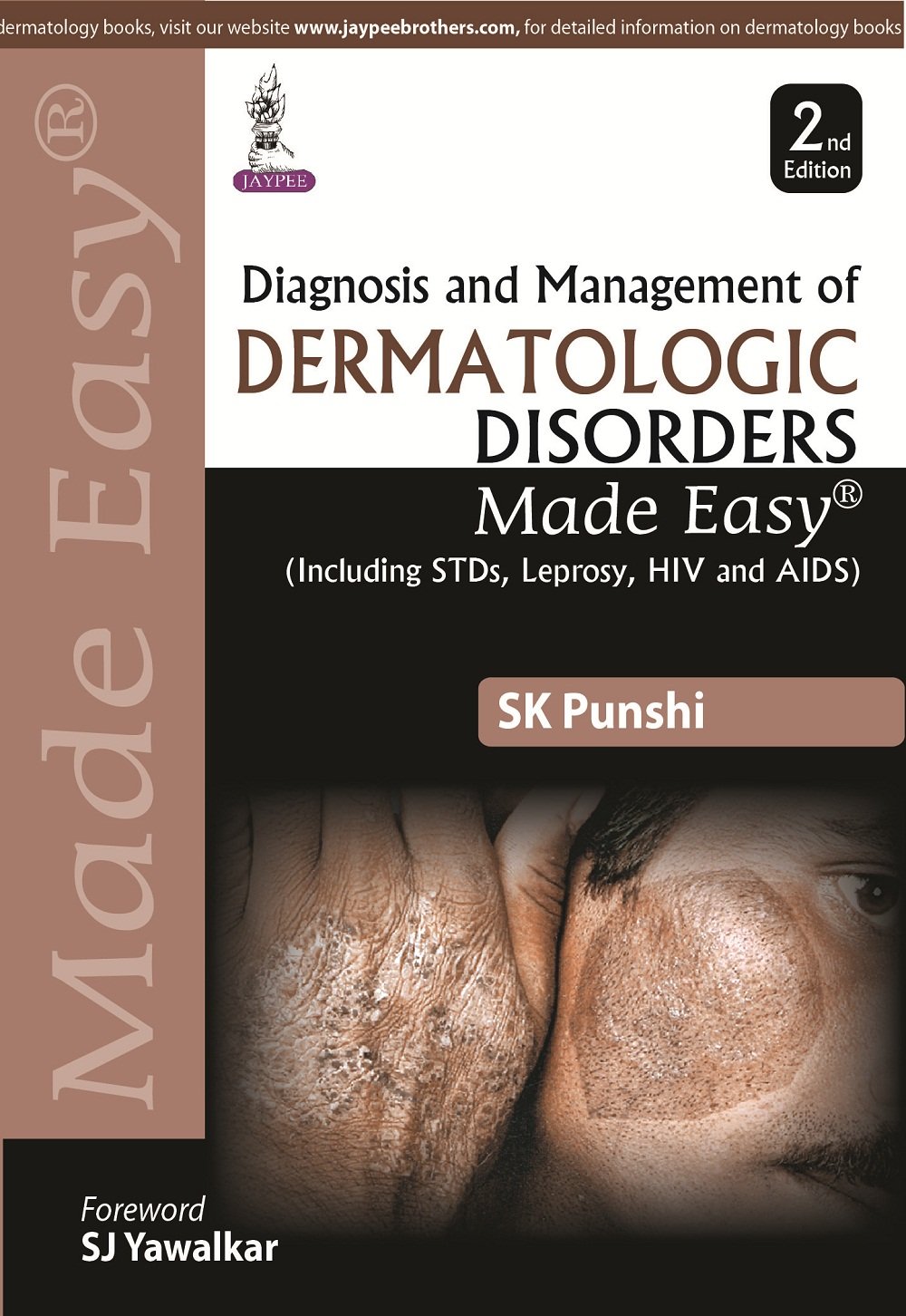 Diagnosis and Management of Dermatologic Disorders Made Easy ...