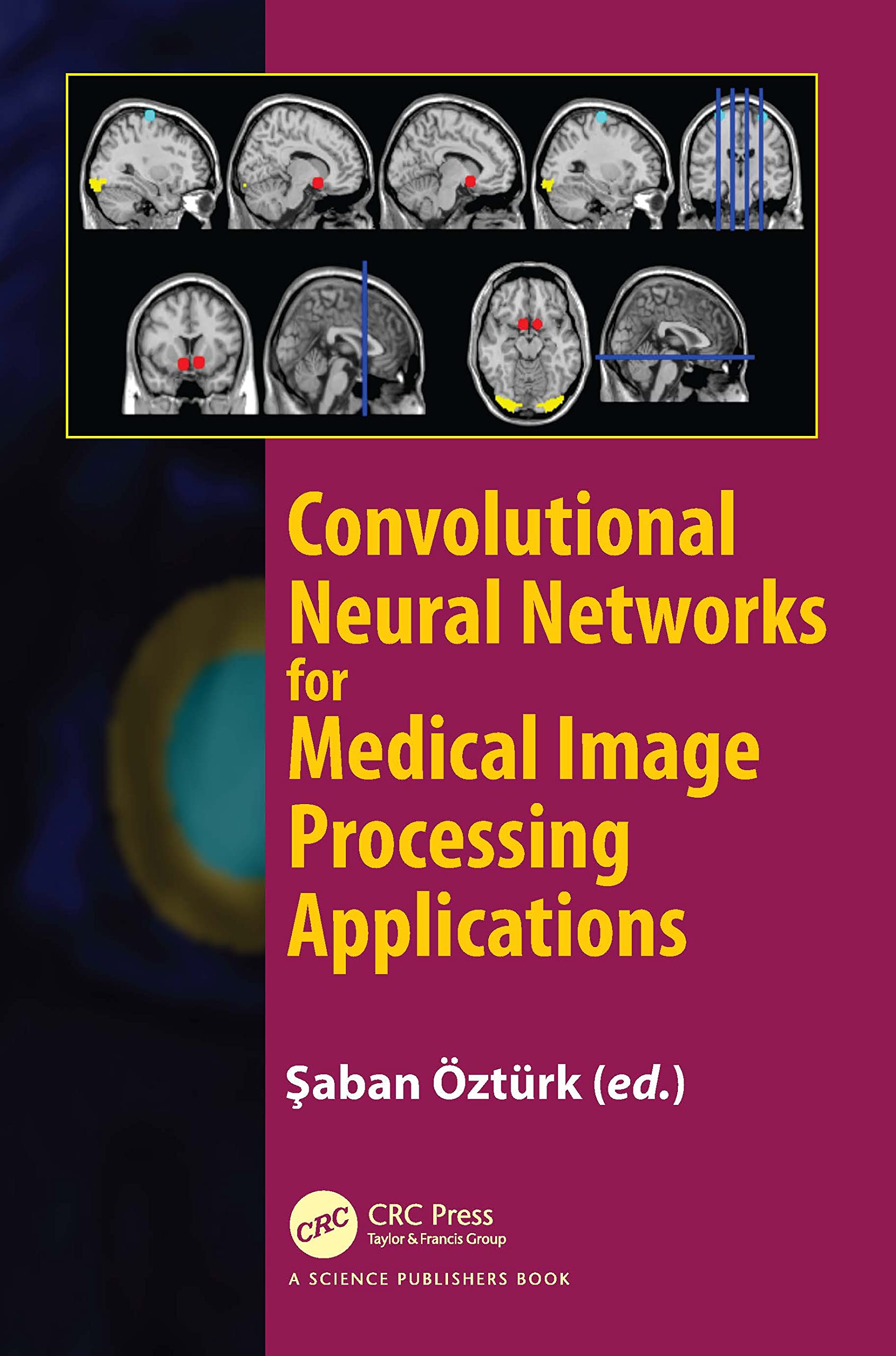 Buy Convolutional Neural Networks for Medical Image Processing ...