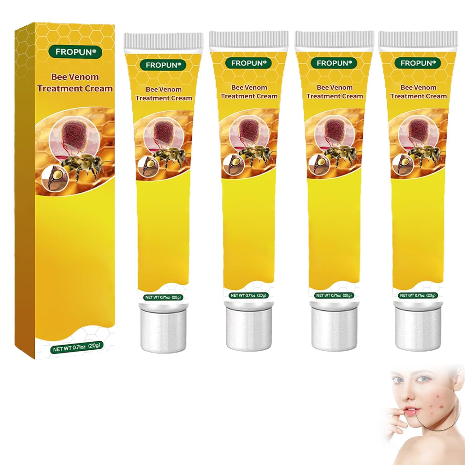 Amazon.com: TLOPA FROPUN Bee Venom Treatment Cream,Acne Treatment for ...