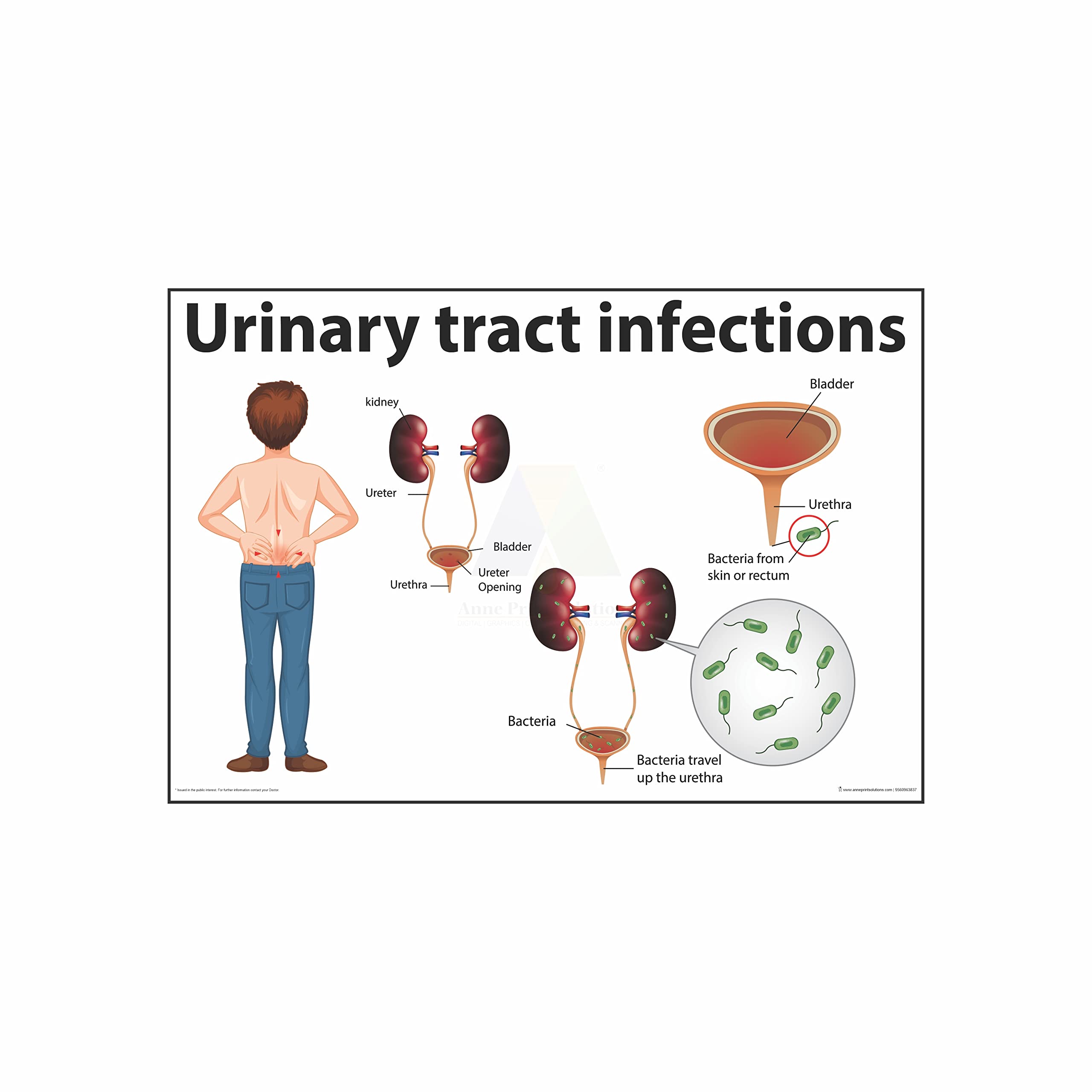 Uti Clipart UTIs Symtoms, Causes And Preventive Measures – Saathi: