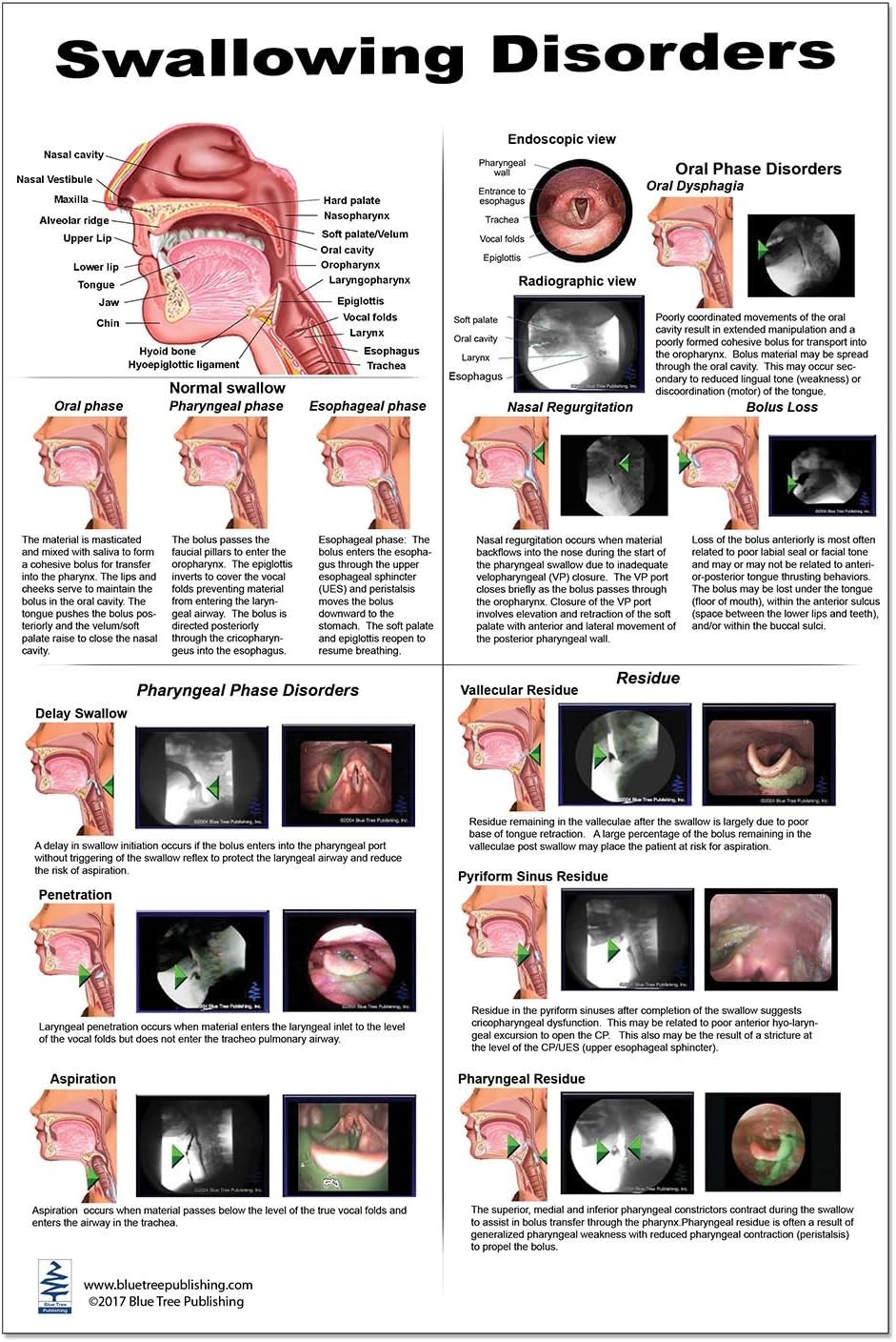 Amazon.com: Blue Tree Publishing Swallow Disorders Anatomy Poster ...