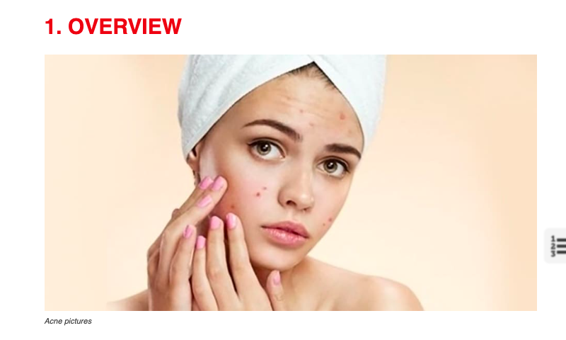 THINGS TO KNOW ABOUT ACNE TREATMENT GUIDELINES - App on Amazon Appstore