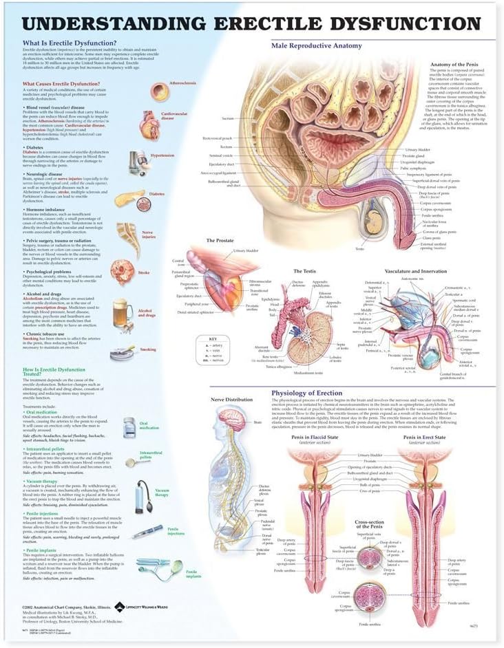 Amazon.com: Understanding Erectile Dysfunction Anatomical Chart : Anatomical Chart Company