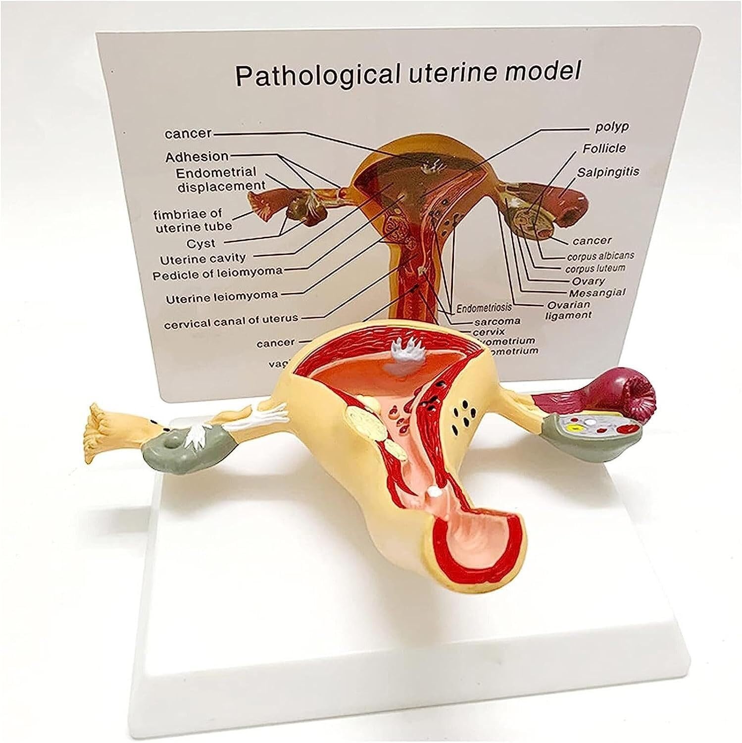 Uterine Ligaments Model