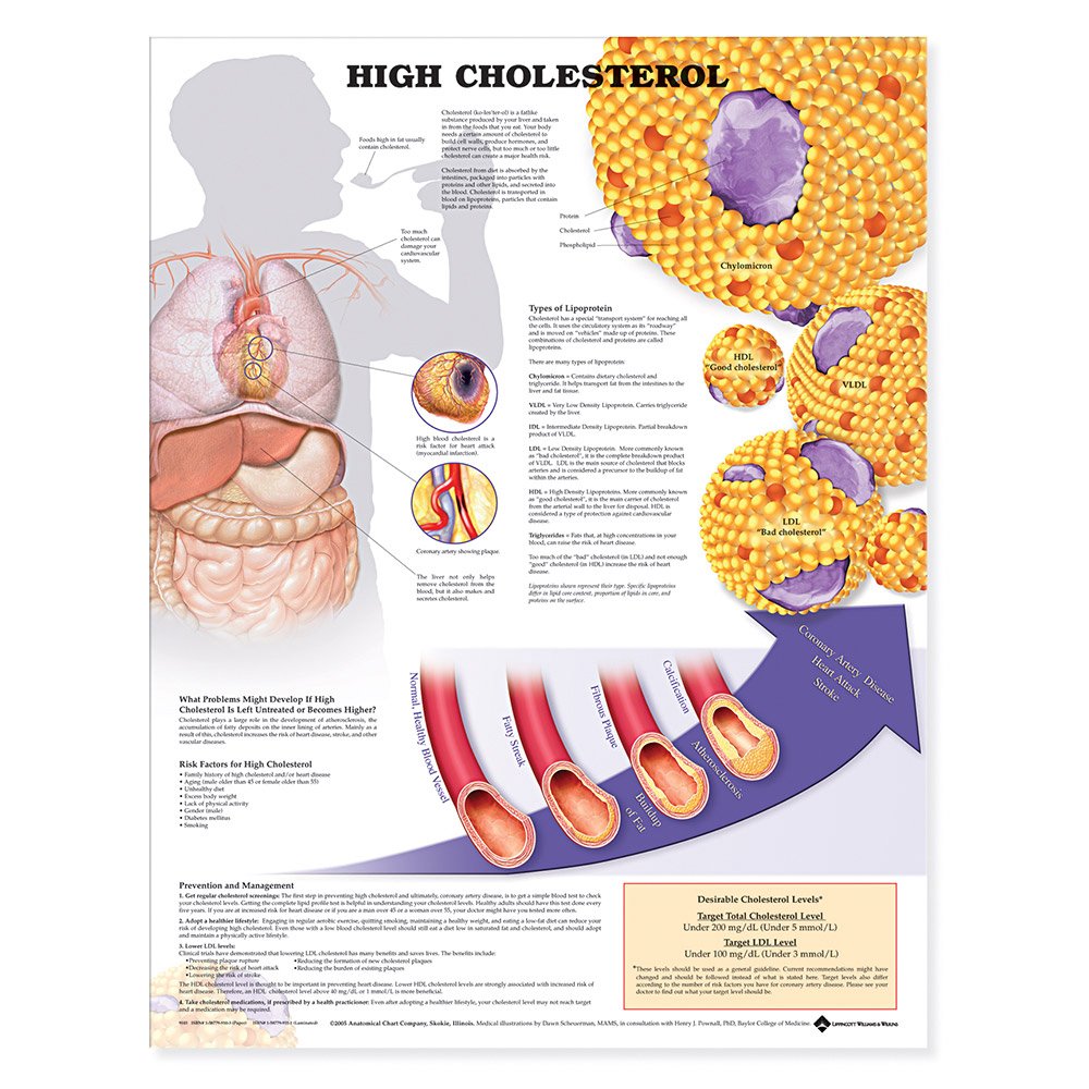 High Cholesterol Anatomical Chart in Spanish (Colesterol Alto) : Amazon.eg
