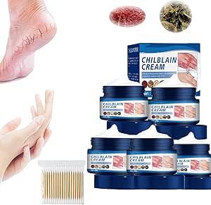 Chilblain Cream-Anti-cracking Frostbite Moisturiser Deep Nourishing ...