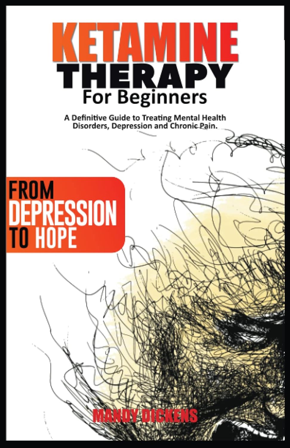 Ketamine Therapy for Beginners: A Definitive Guide to Treating Mental ...