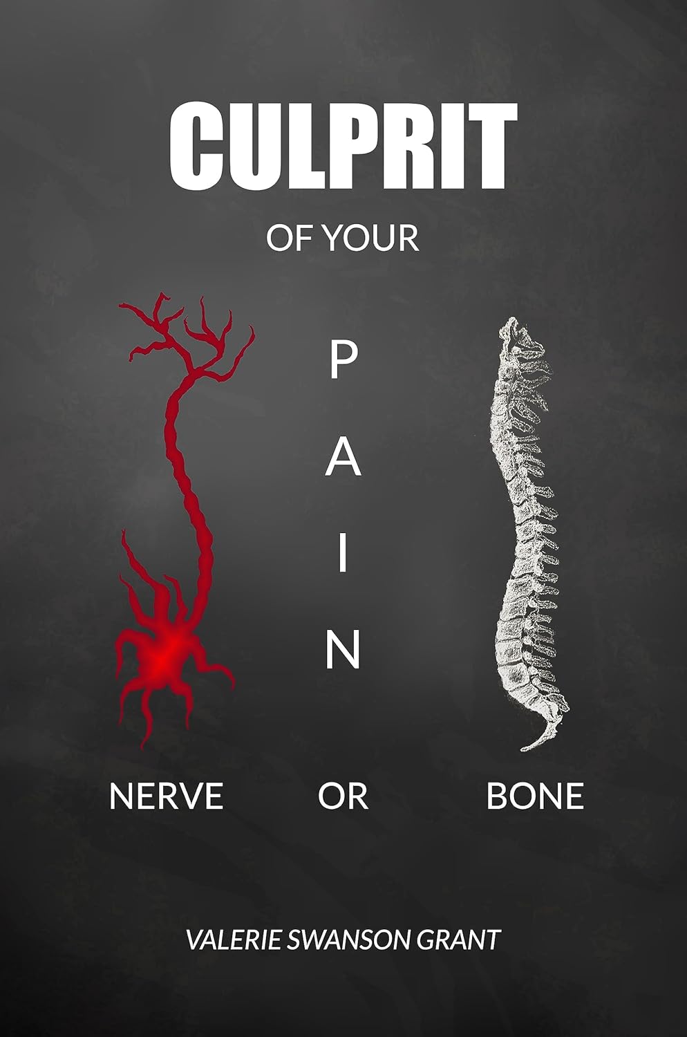 Culprit of Your Pain: Nerve or Bone - Kindle edition by Swanson Grant ...