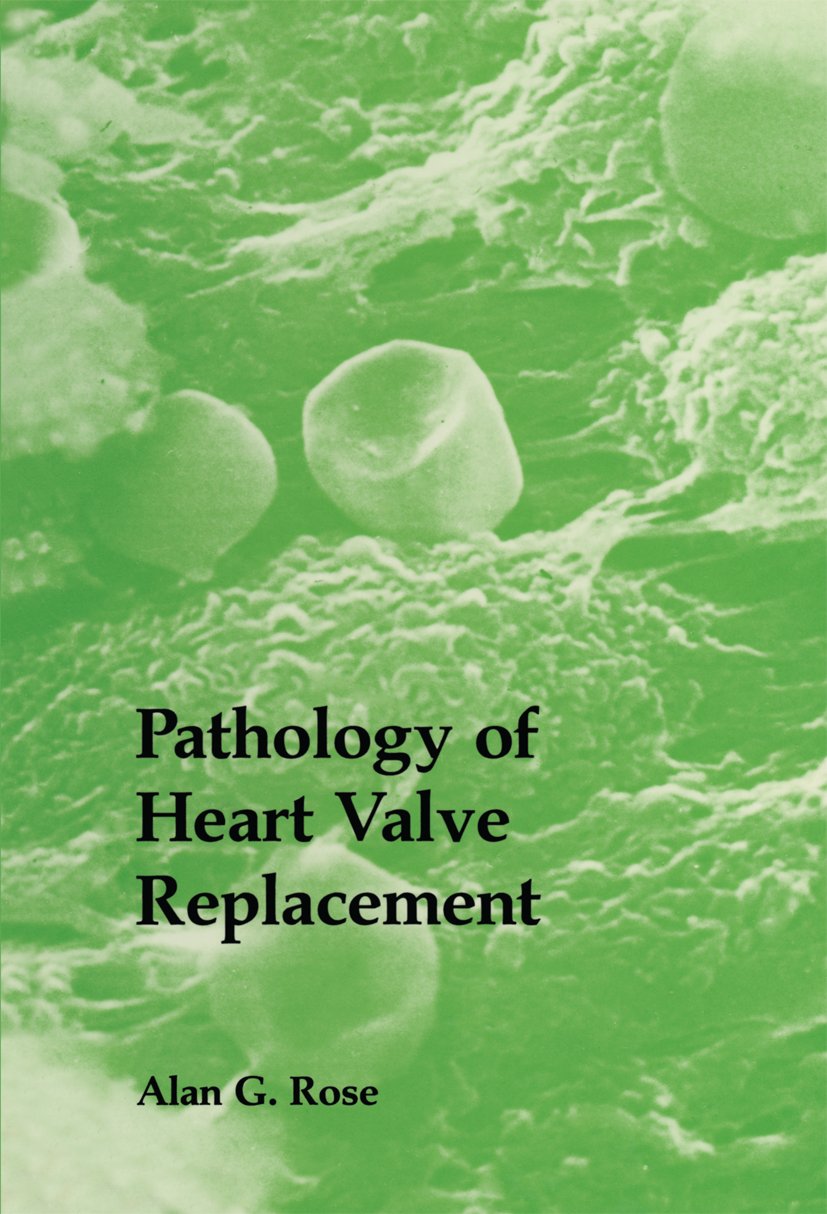 Amazon.com: Pathology of Heart Valve Replacement eBook : Rose, A.G ...