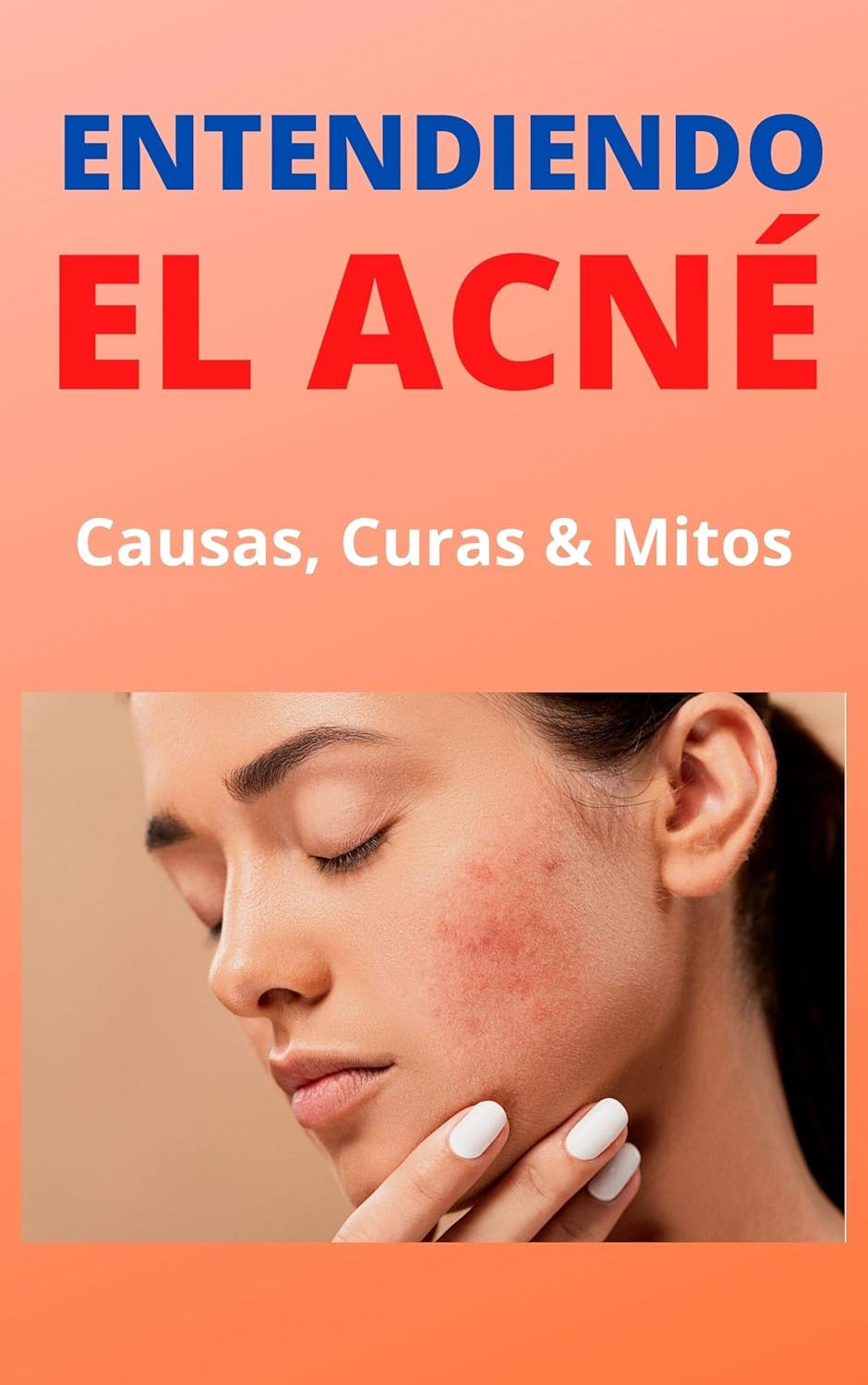 Entendiendo El Acné (Spanish Edition) - Kindle edition by Germoso ...