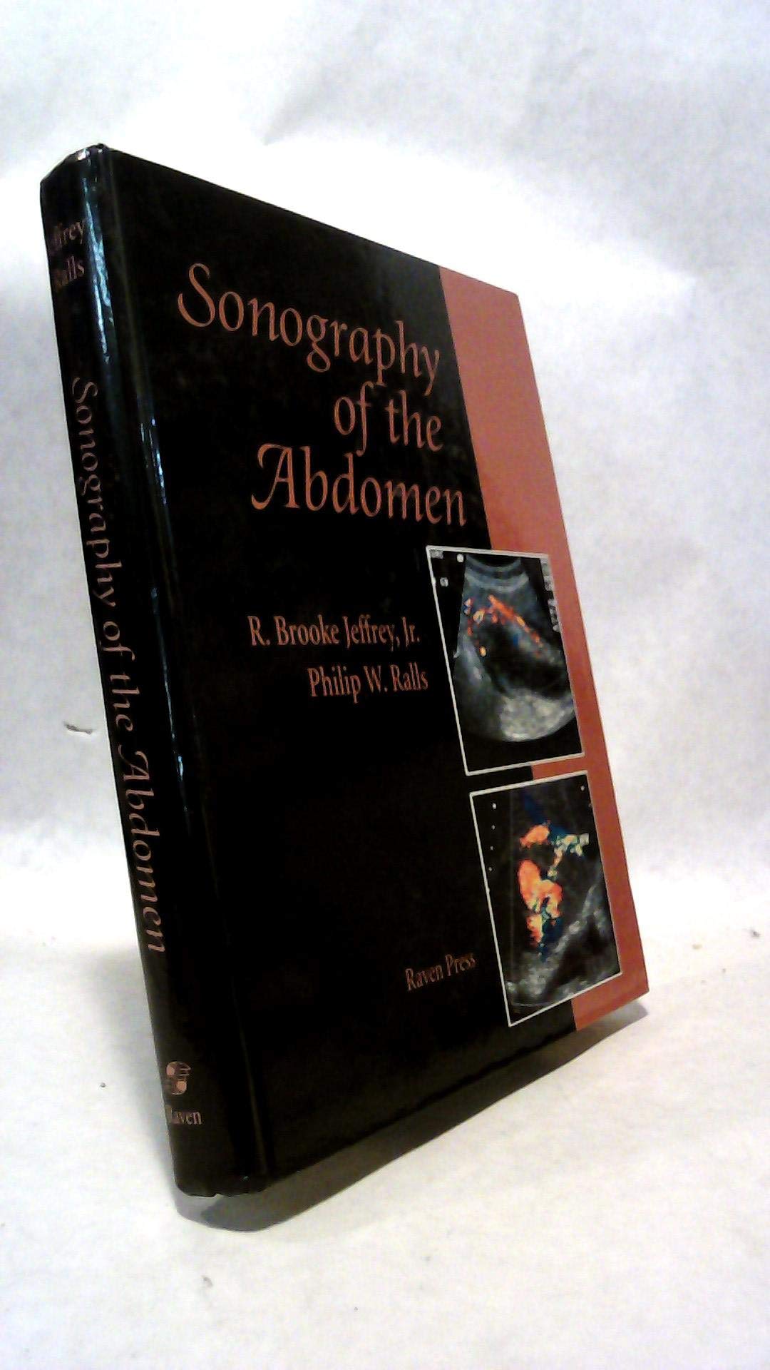 Sonography of the Abdomen: Jeffrey, R. Brooke, Ralls, Philip W ...