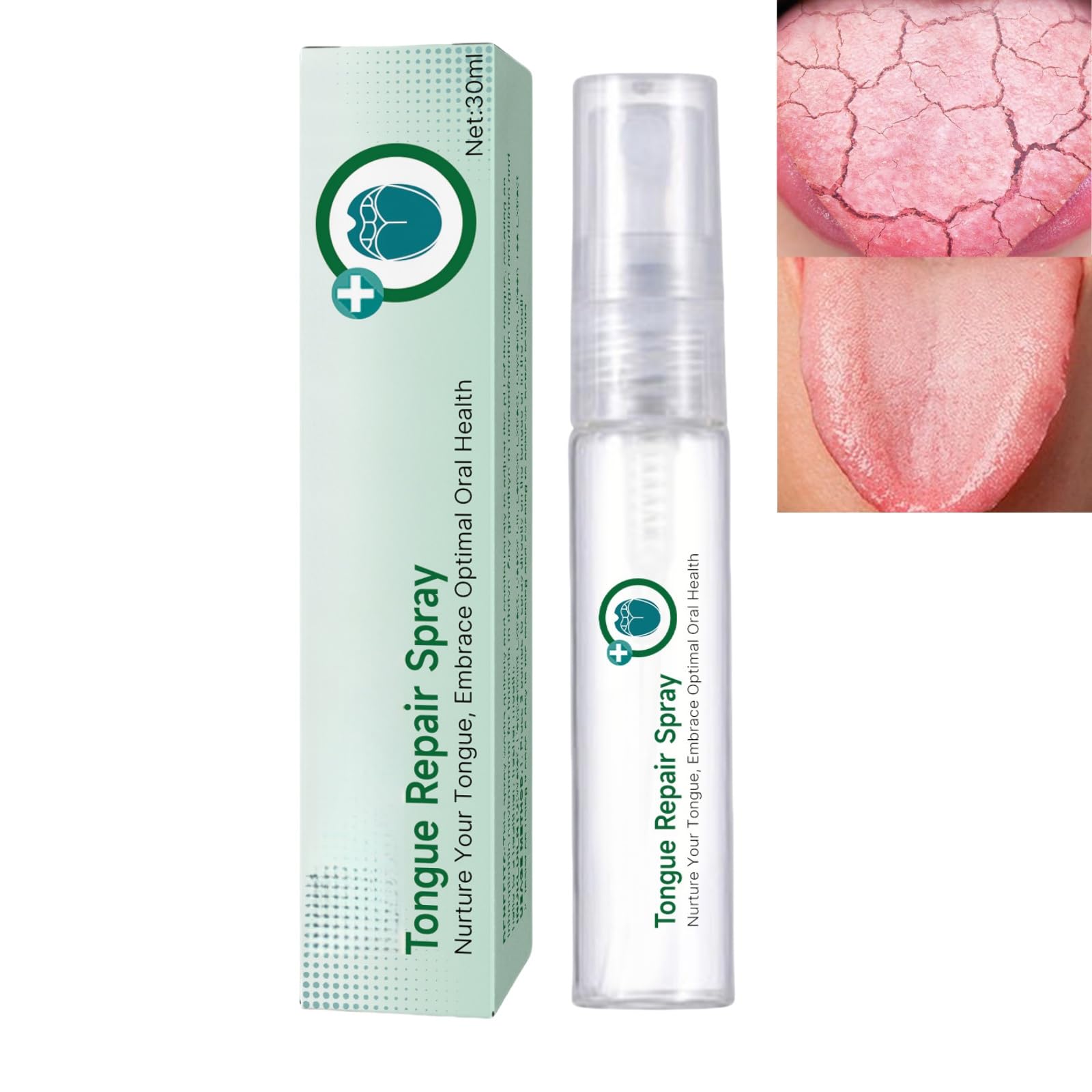Fissured Tongue Relief Spray,Tongue Repair Sprays,Sore Tongue Relief ...