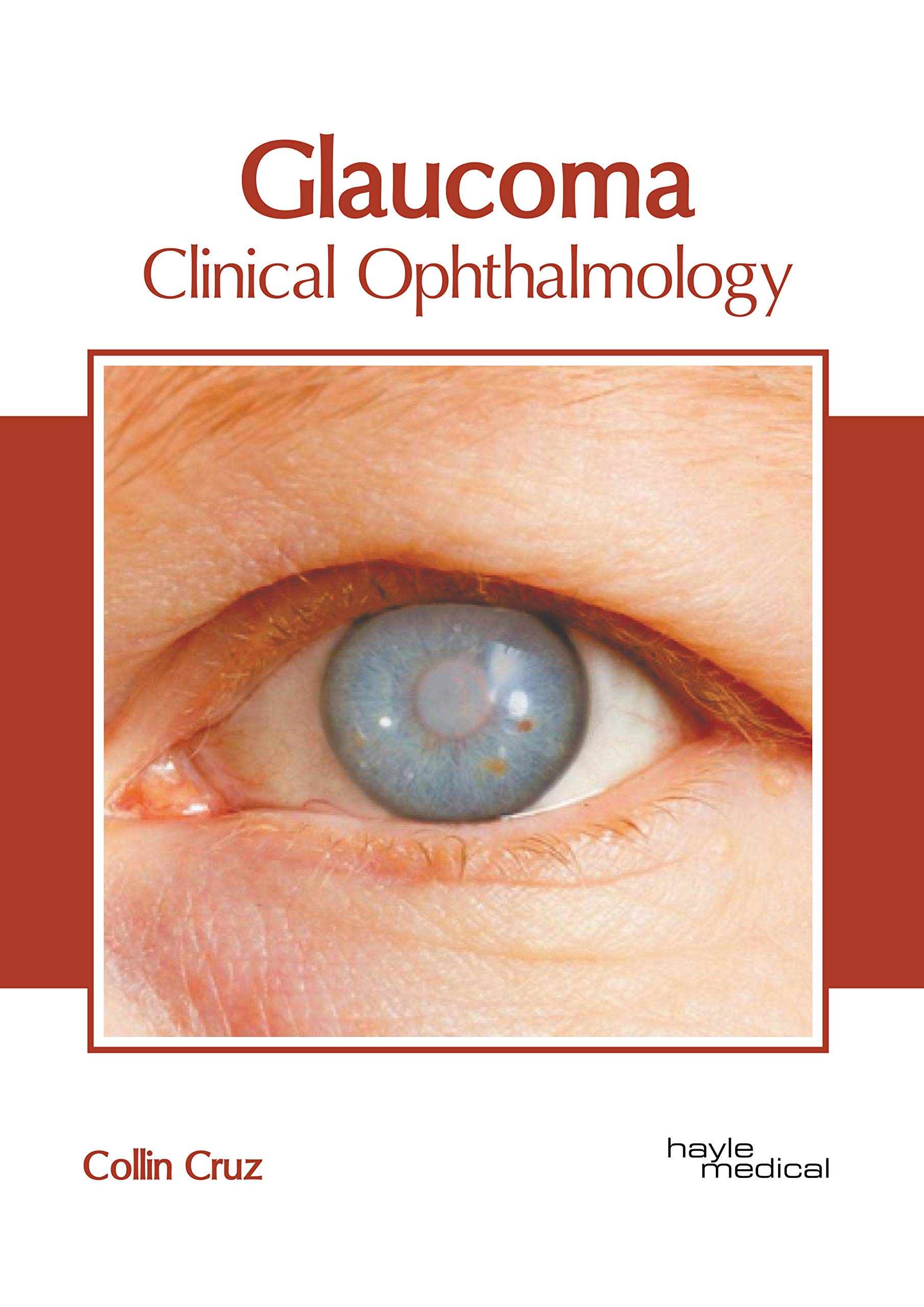 Glaucoma: Clinical Ophthalmology: 9781632418975: Medicine & Health ...
