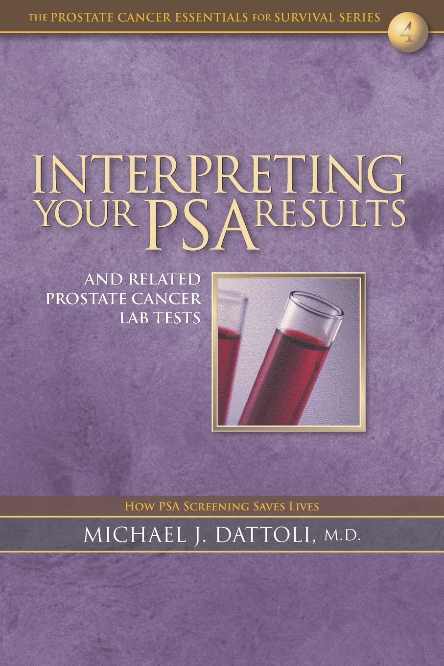 Interpreting Your PSA Results and Related Prostate Cancer Lab Tests ...