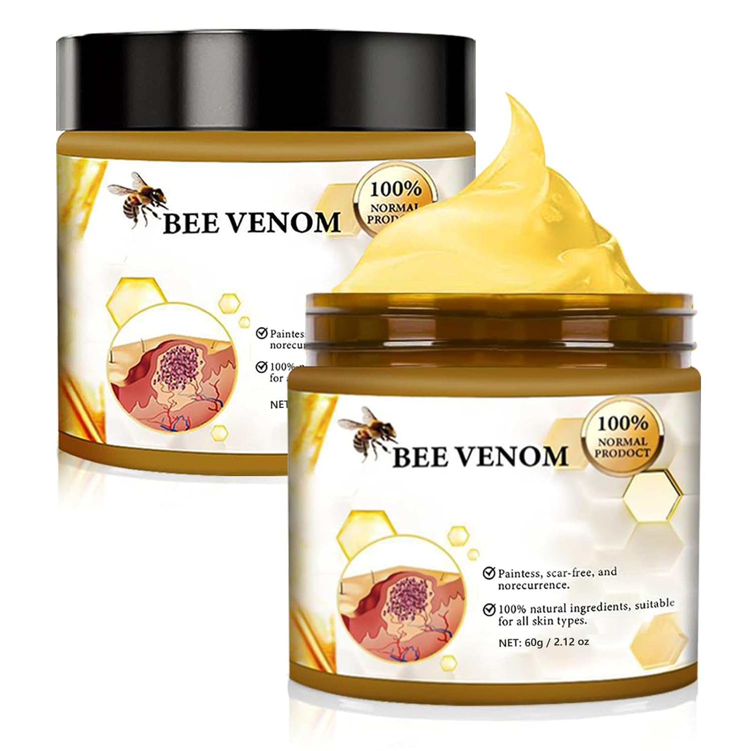 Amazon.com: 2PCS Bee Venom Cream, Bee Venom Skin Treatment Cream for ...