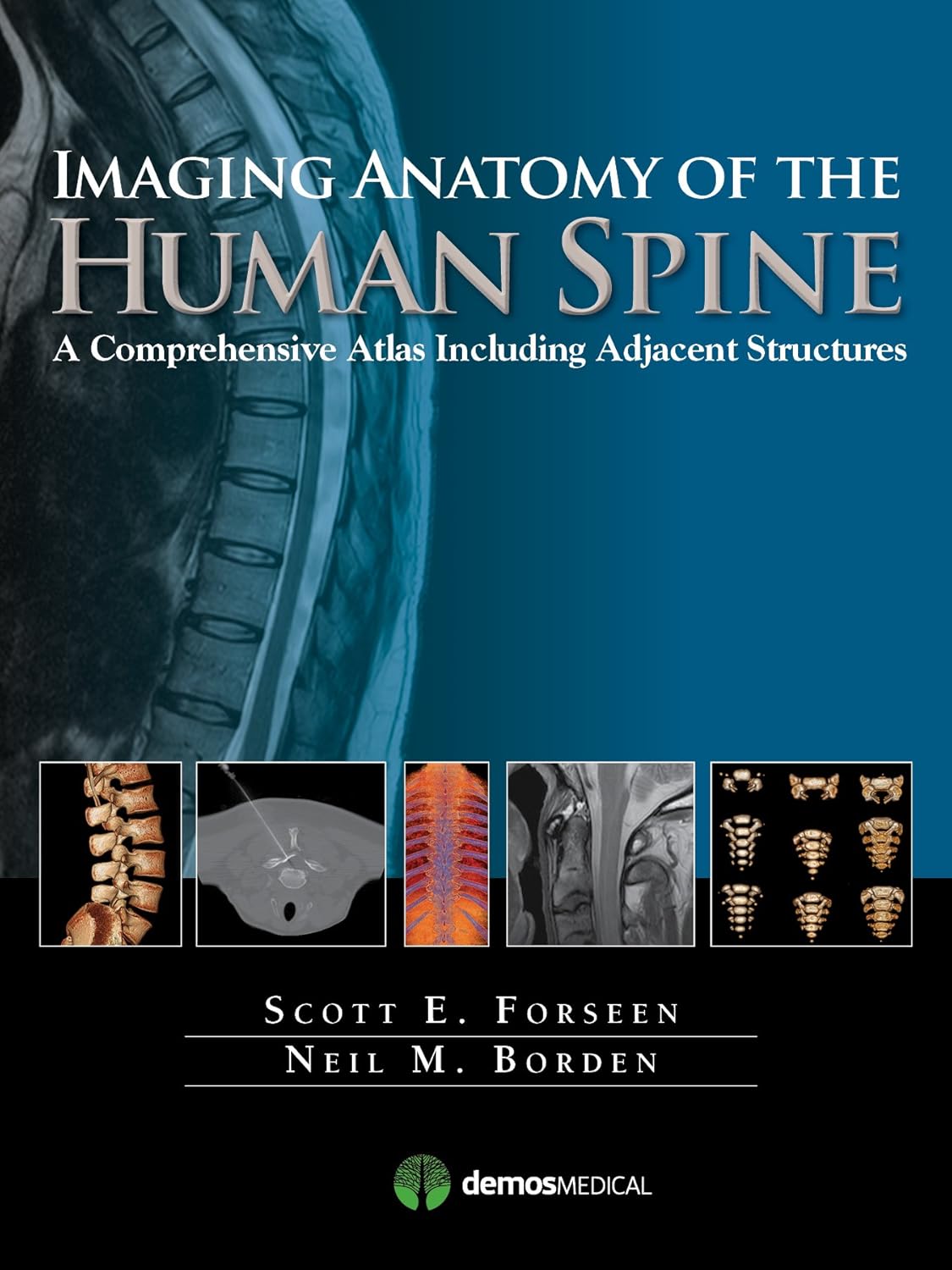 Imaging Anatomy of the Human Spine: A Comprehensive Atlas Including ...