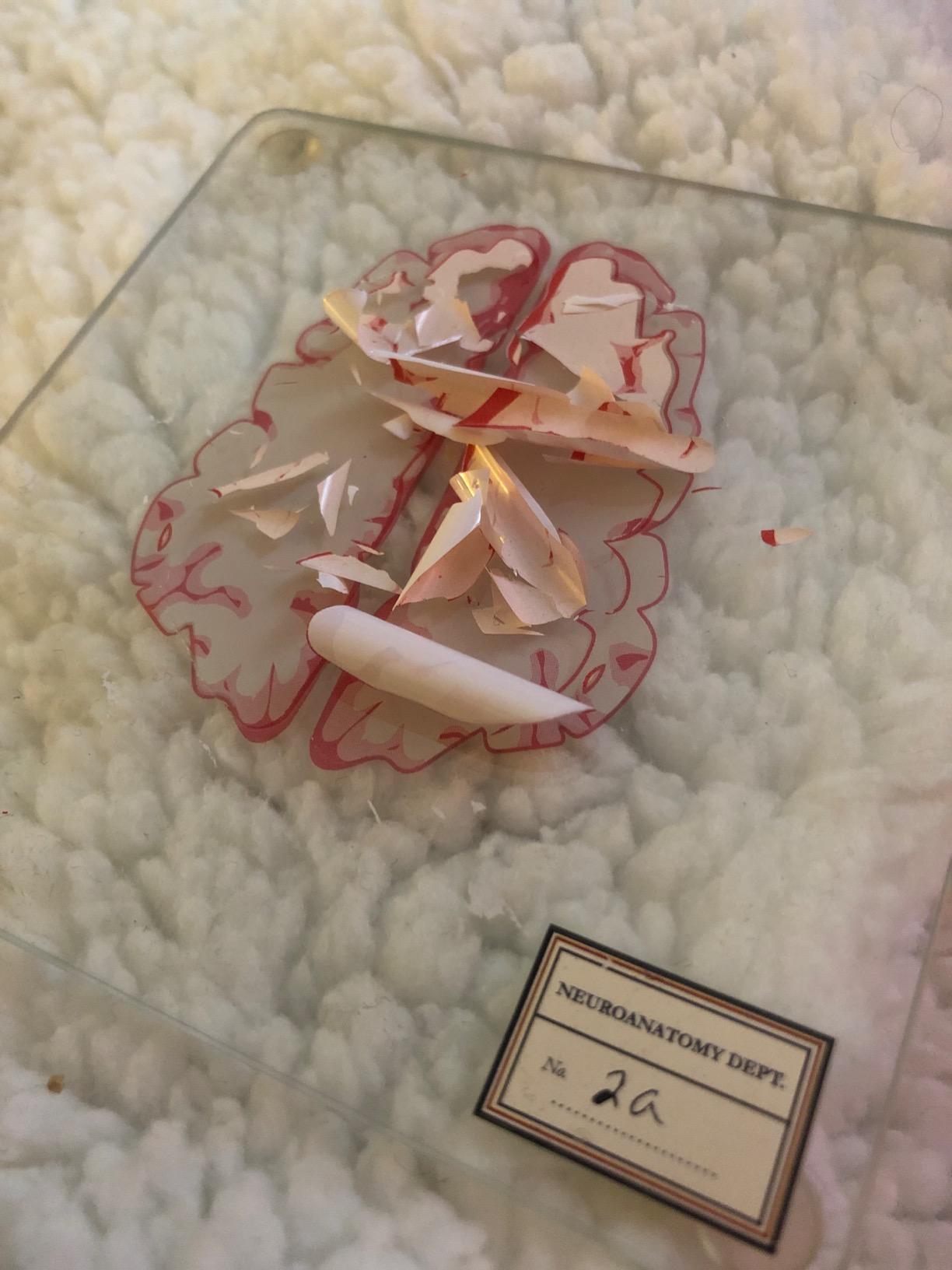 Amazon.com | Brain Specimen Coasters: Coasters