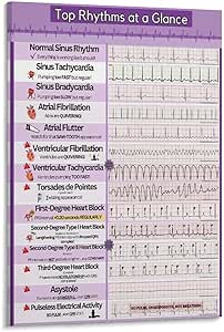 Amazon.com: Ekg And Ecg Rhythms Poster Medical Student Poster Canvas ...