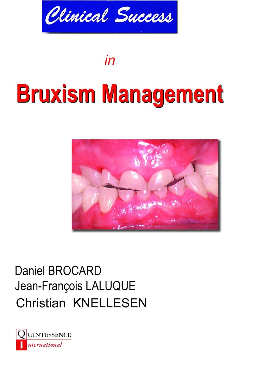 Clinical Success in Bruxism Management: 9782912550613: Medicine ...